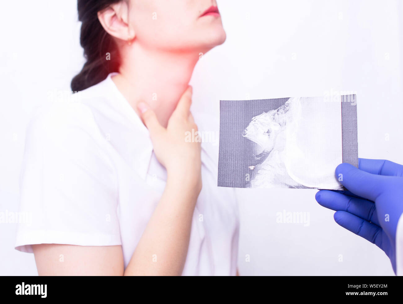 Adenoids High Resolution Stock Photography and Images - Alamy