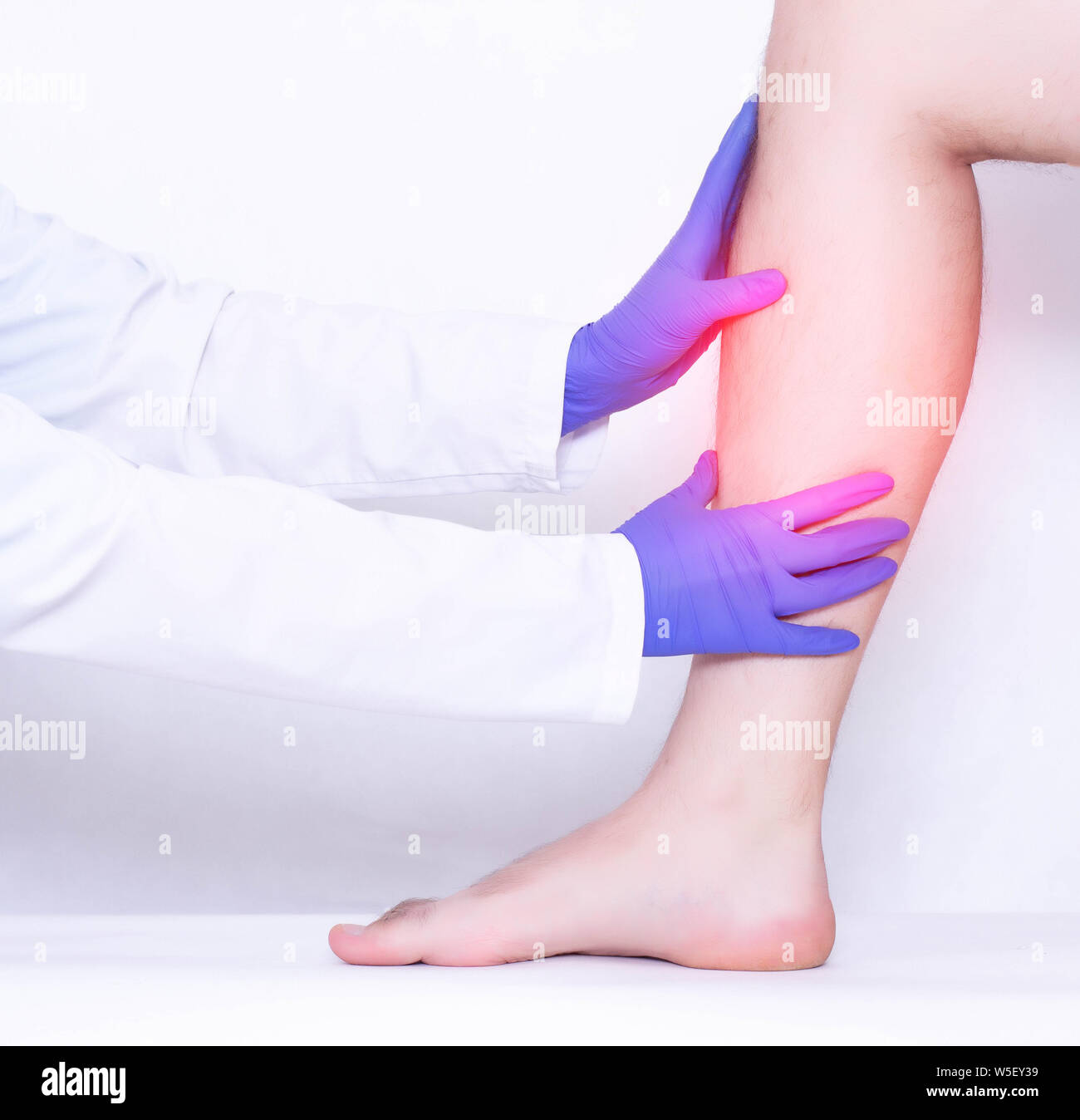 Muscle ligament sprains hi-res stock photography and images - Alamy