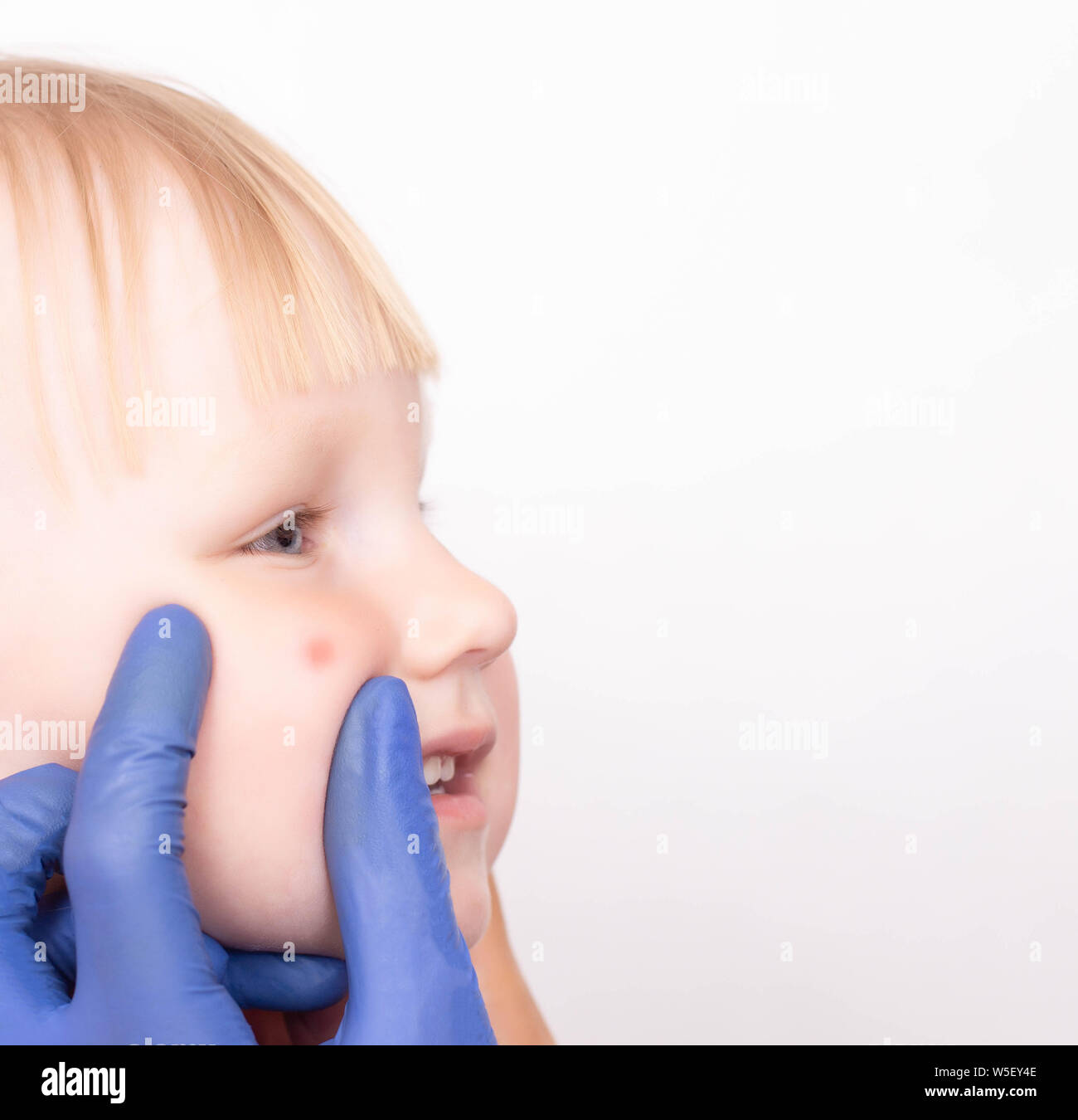 Dermatology Consultation Child High Resolution Stock Photography and ...