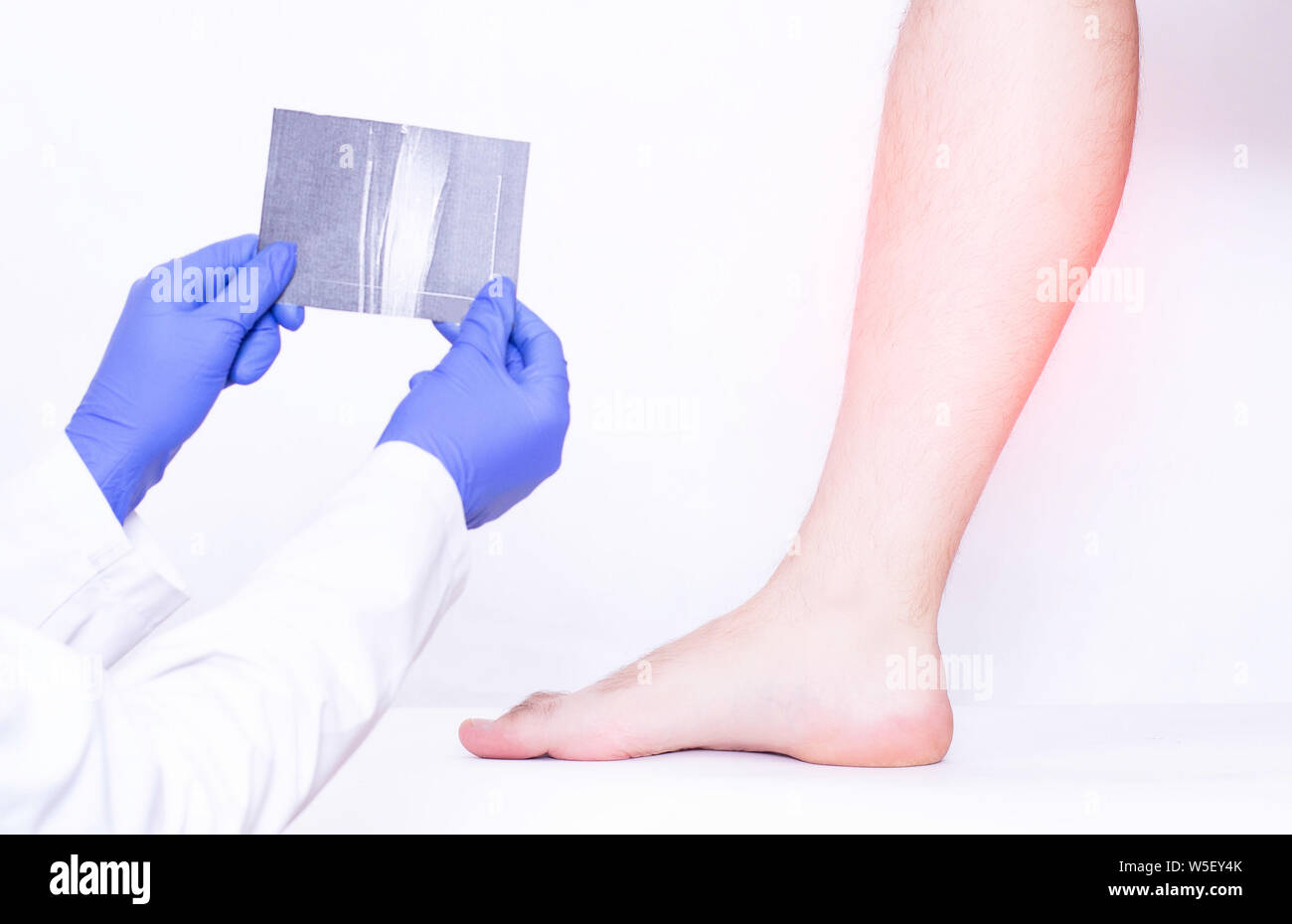 Doctor Traumatologist holds MRI snapshot of the calf ligaments of the ...