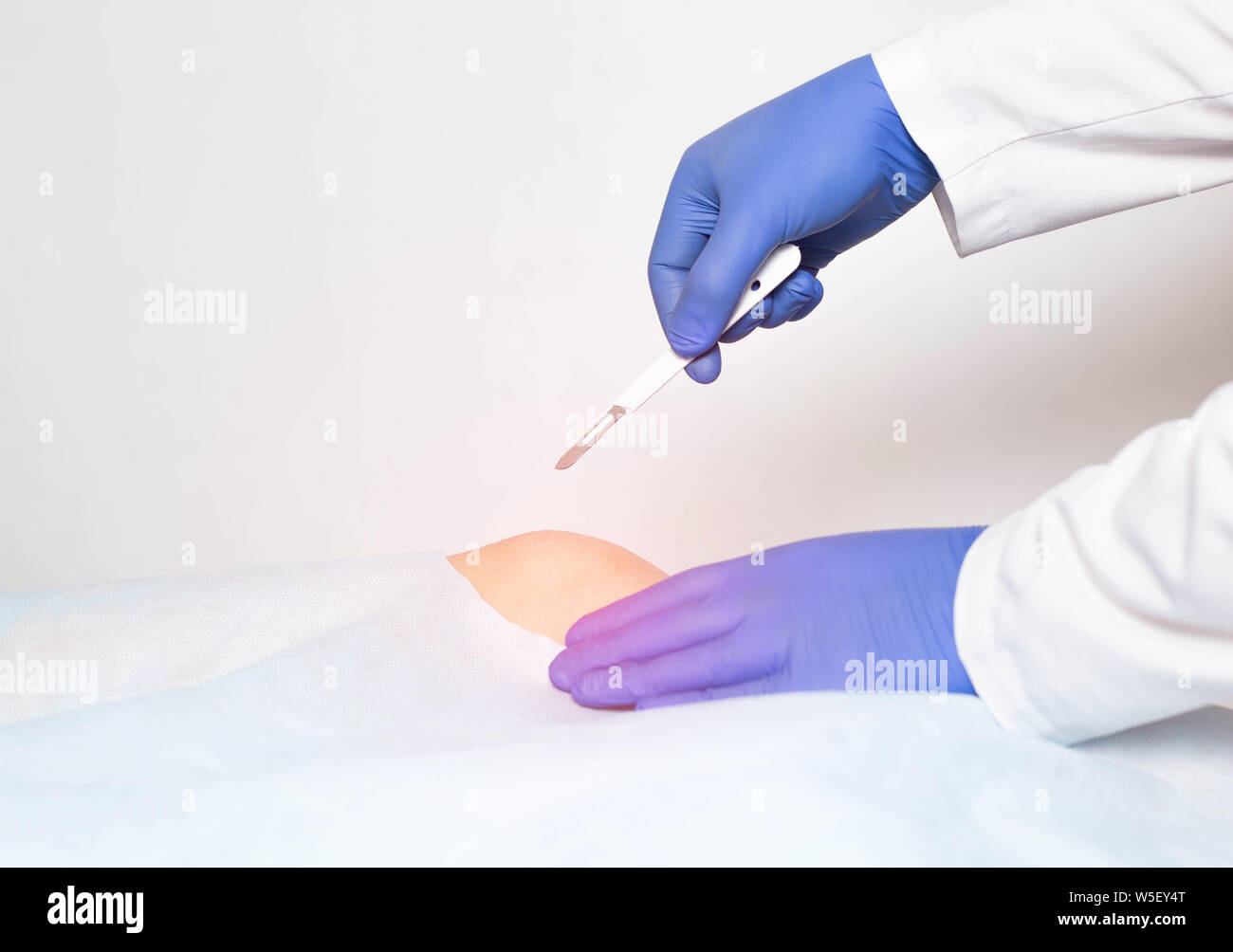 Doctor surgeon with a scalpel in his hand makes an incision in the knee ...