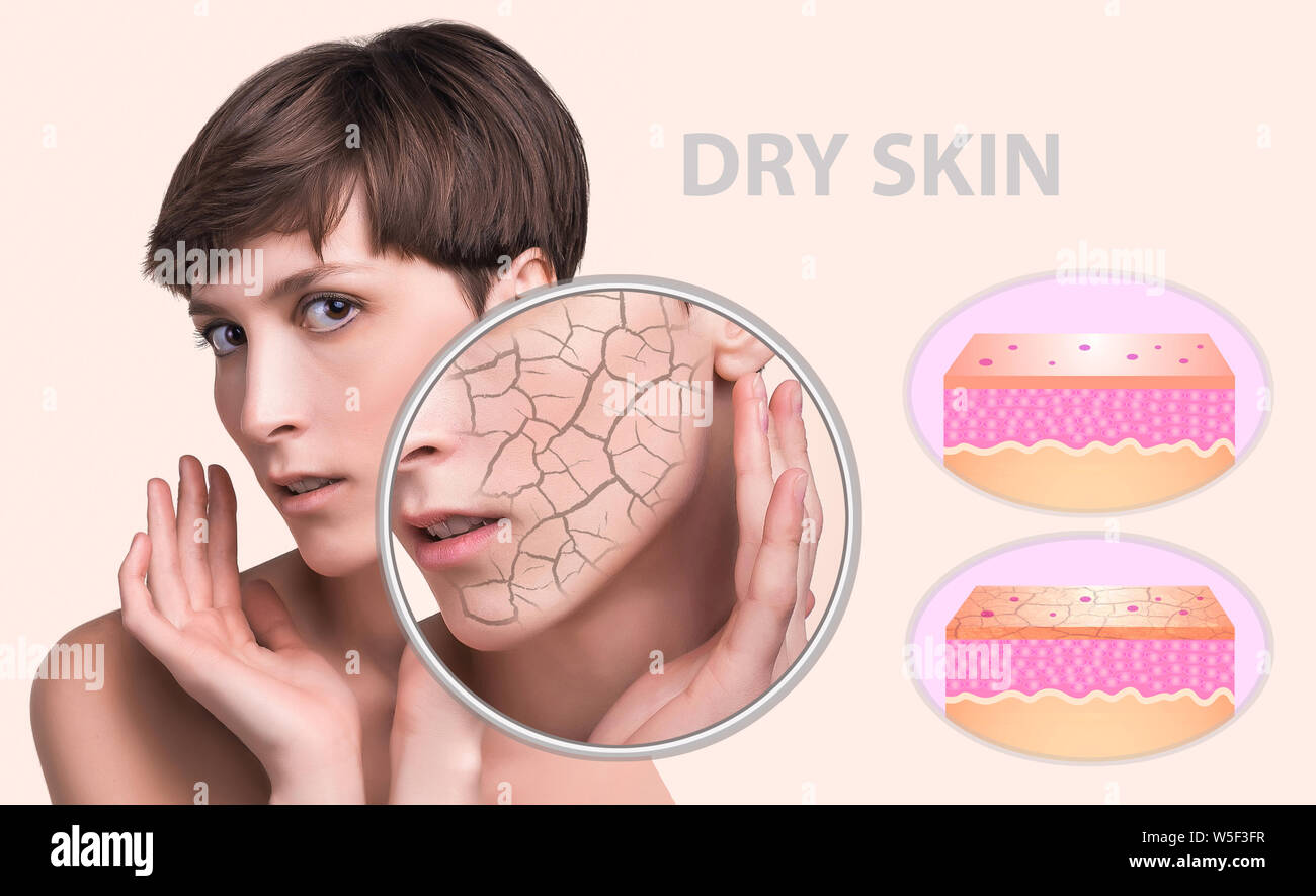 Skin cracks woman hi-res stock photography and images - Alamy