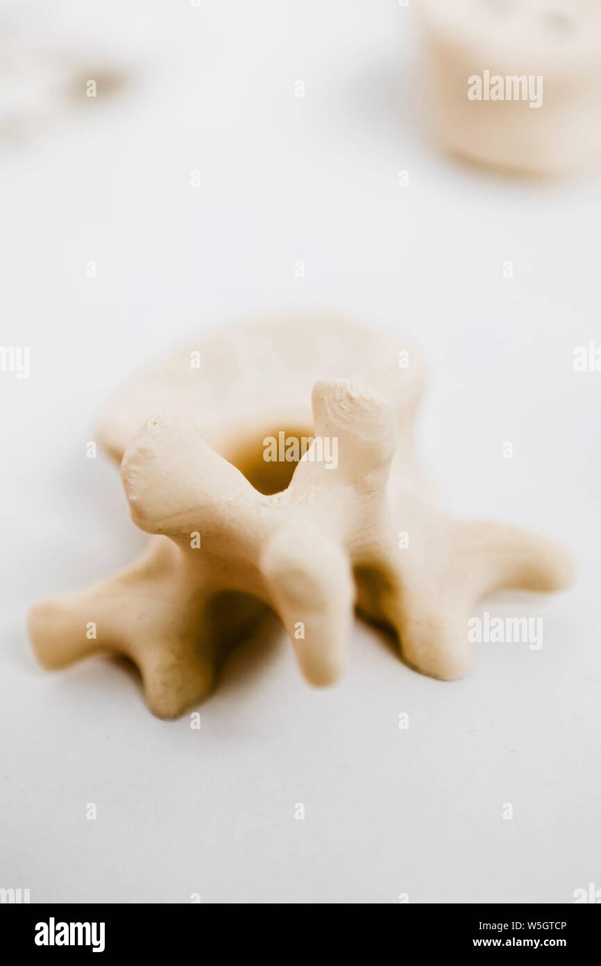 Accessory process superior articular process hi-res stock photography ...