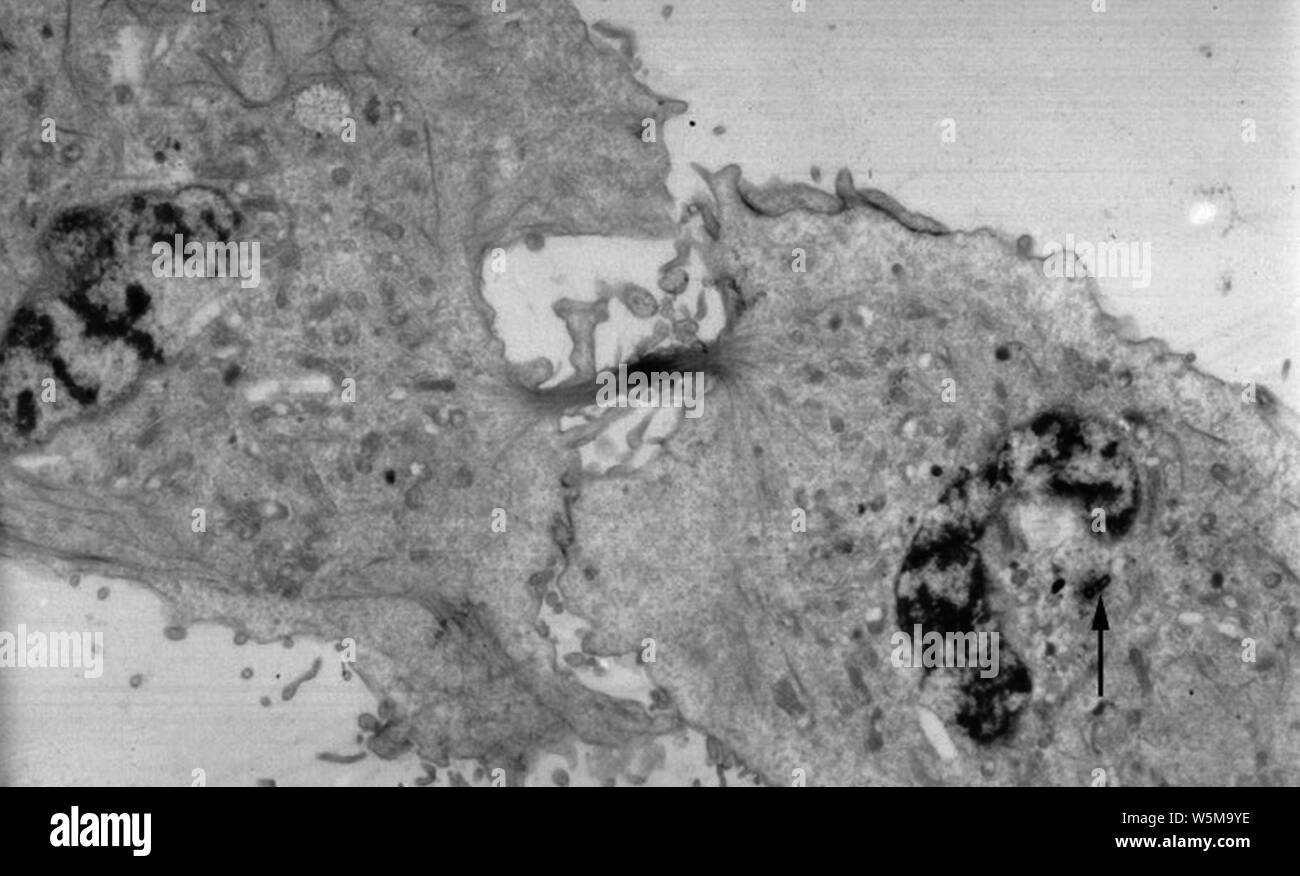 Photo micrograph hi-res stock photography and images - Alamy