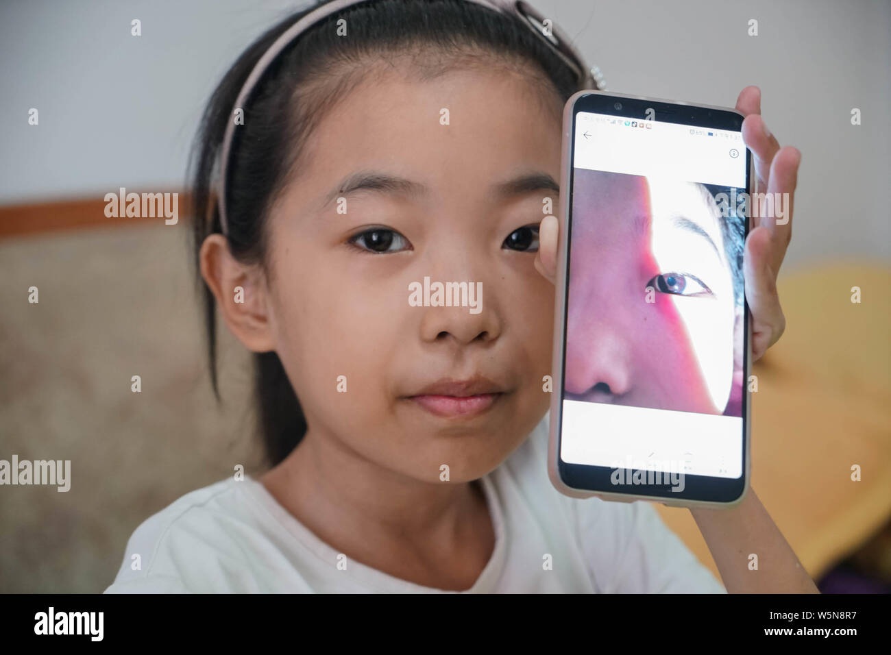 13-year-old Chinese girl Zhang Bohan diagnosed with Gaucher's disease ...