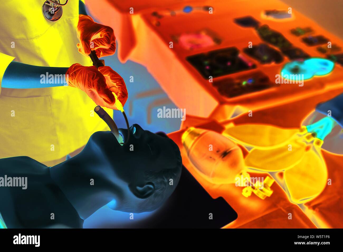 Intubation hi-res stock photography and images - Alamy