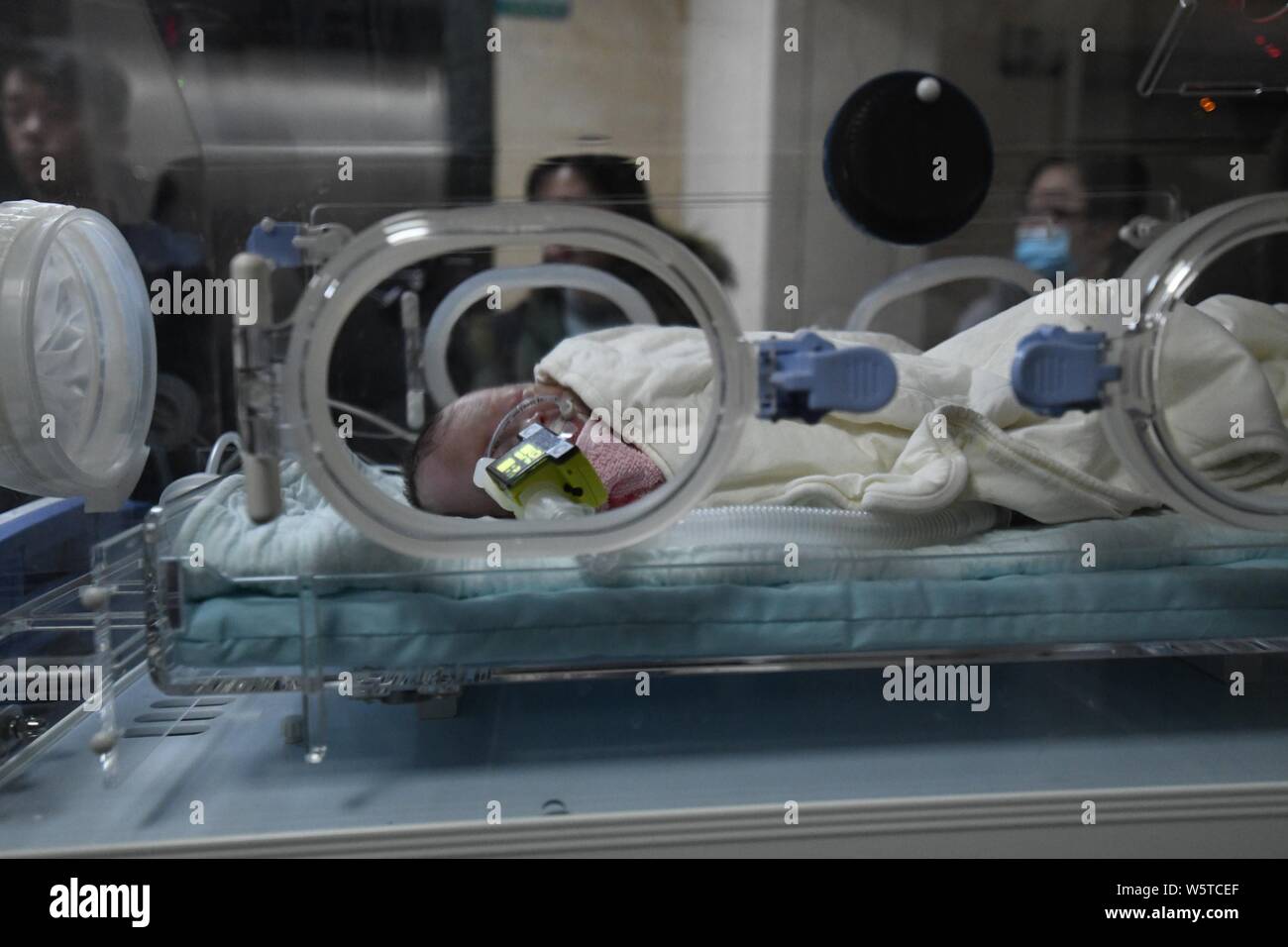 The palm-sized baby, a 800-gram premature baby who suffered from a ...