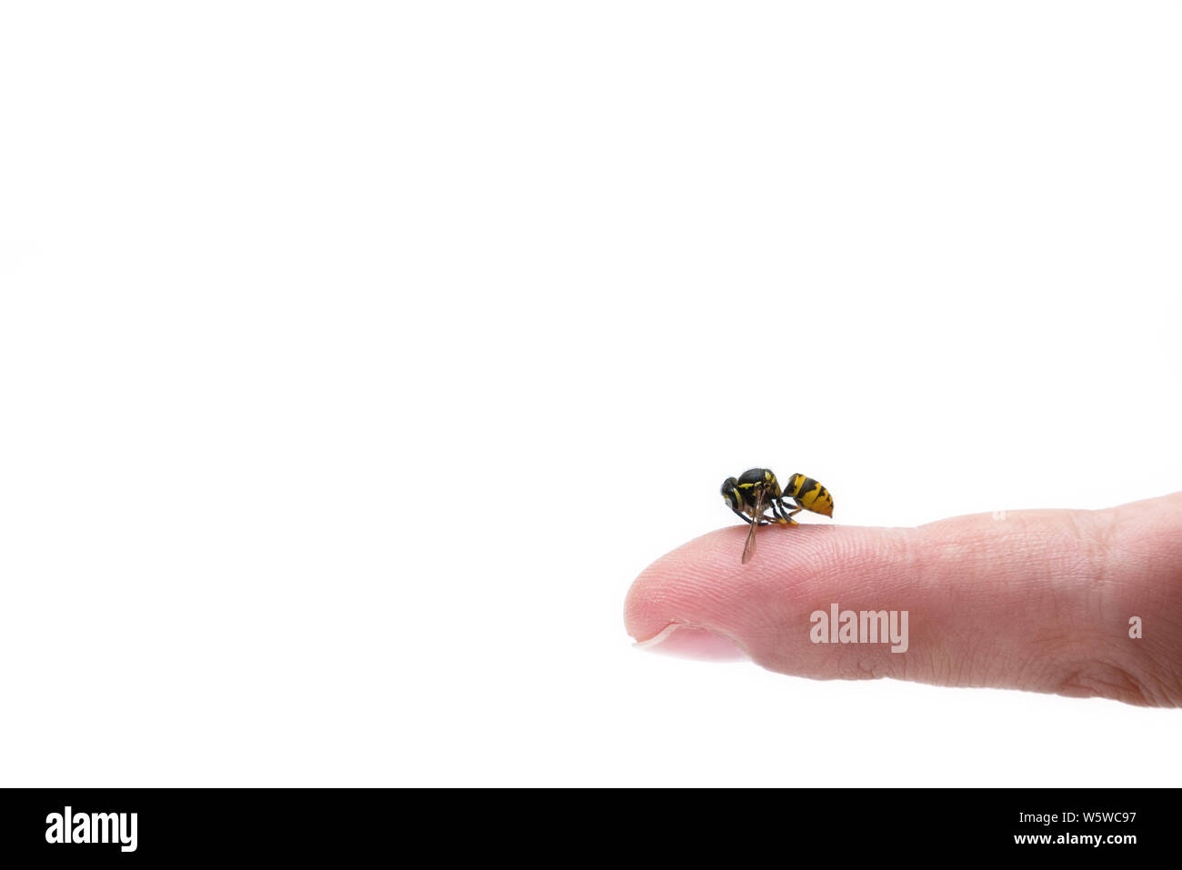 Bumble Bee Sting Reaction