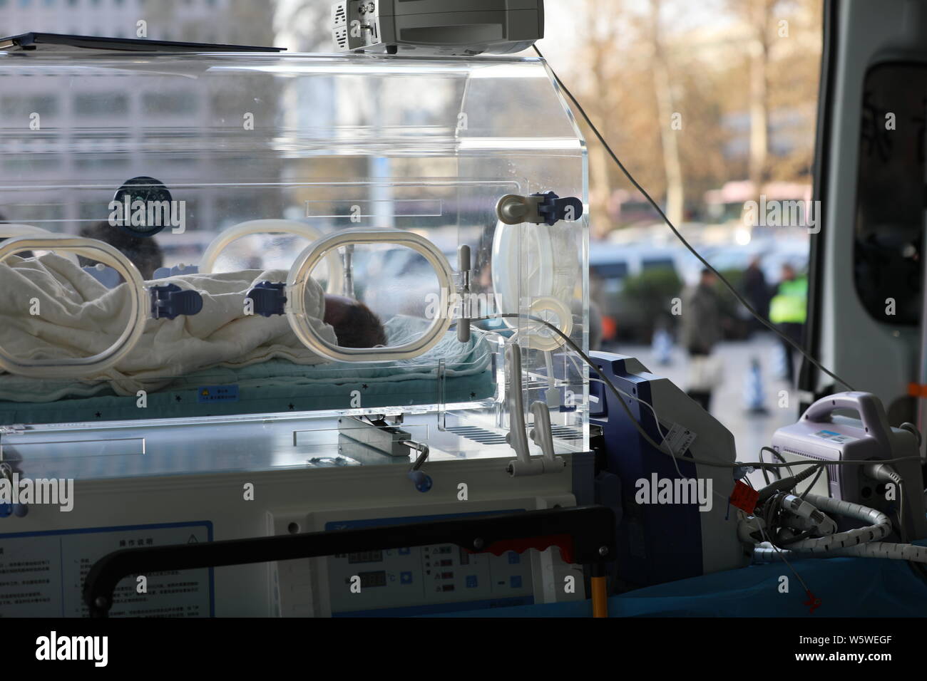 The palm-sized baby, a 800-gram premature baby who suffered from a ...