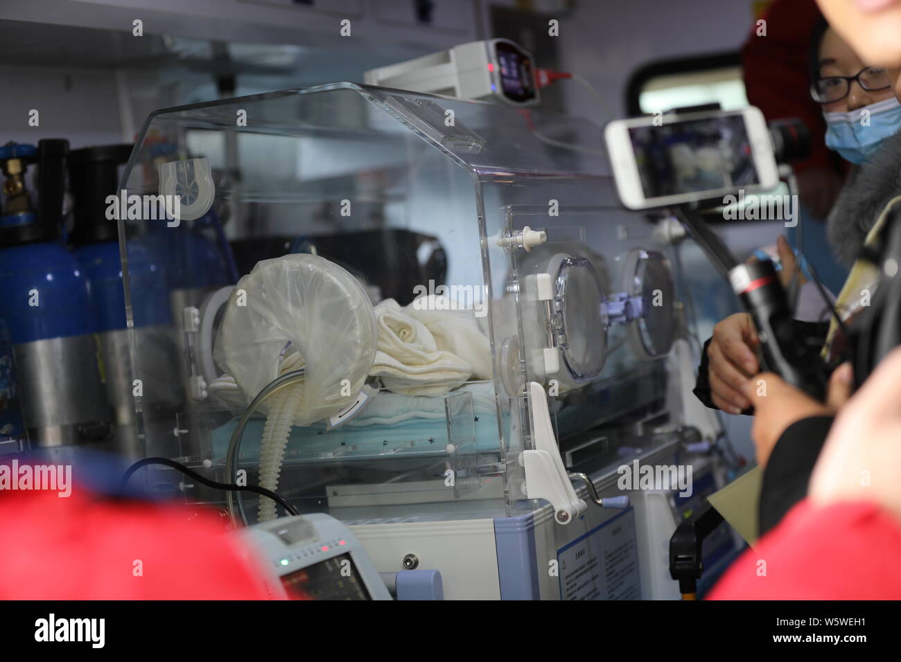 The palm-sized baby, a 800-gram premature baby who suffered from a ...