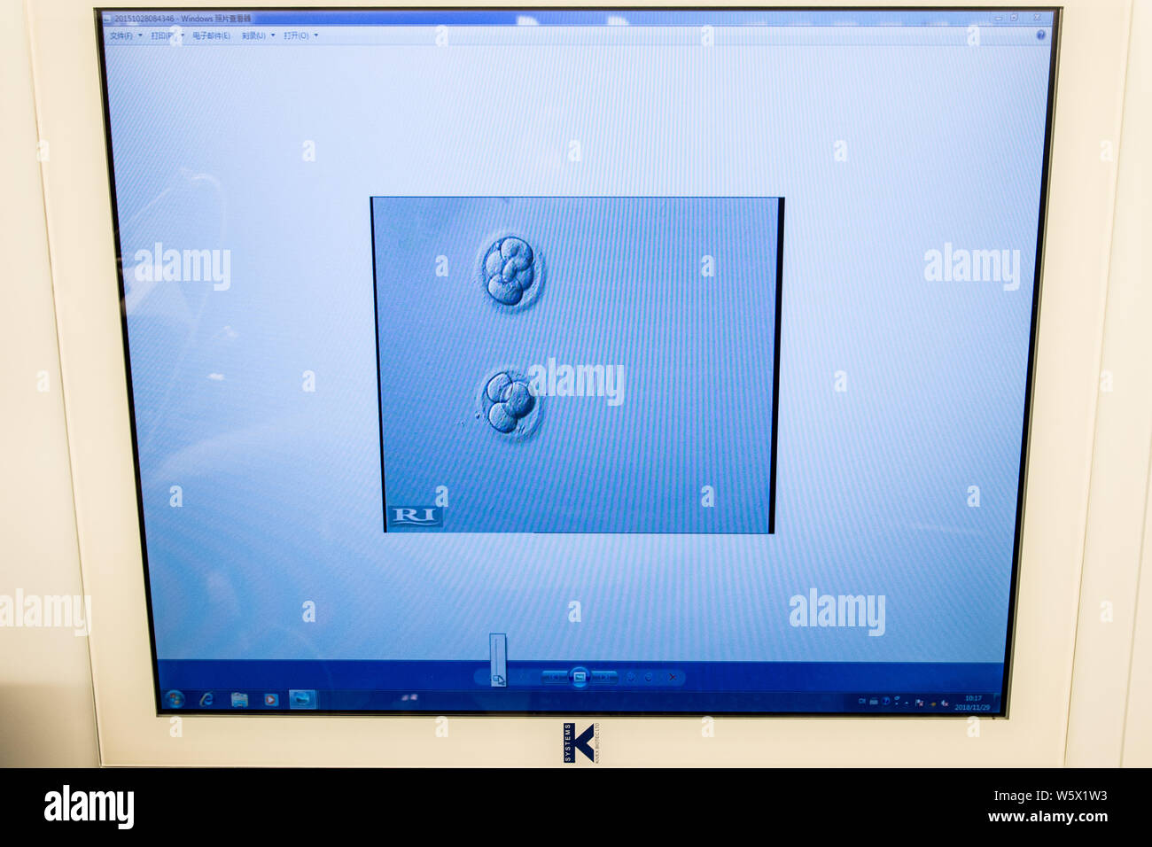 A picture is shown on the screen to display fertilized eggs or embryos ...