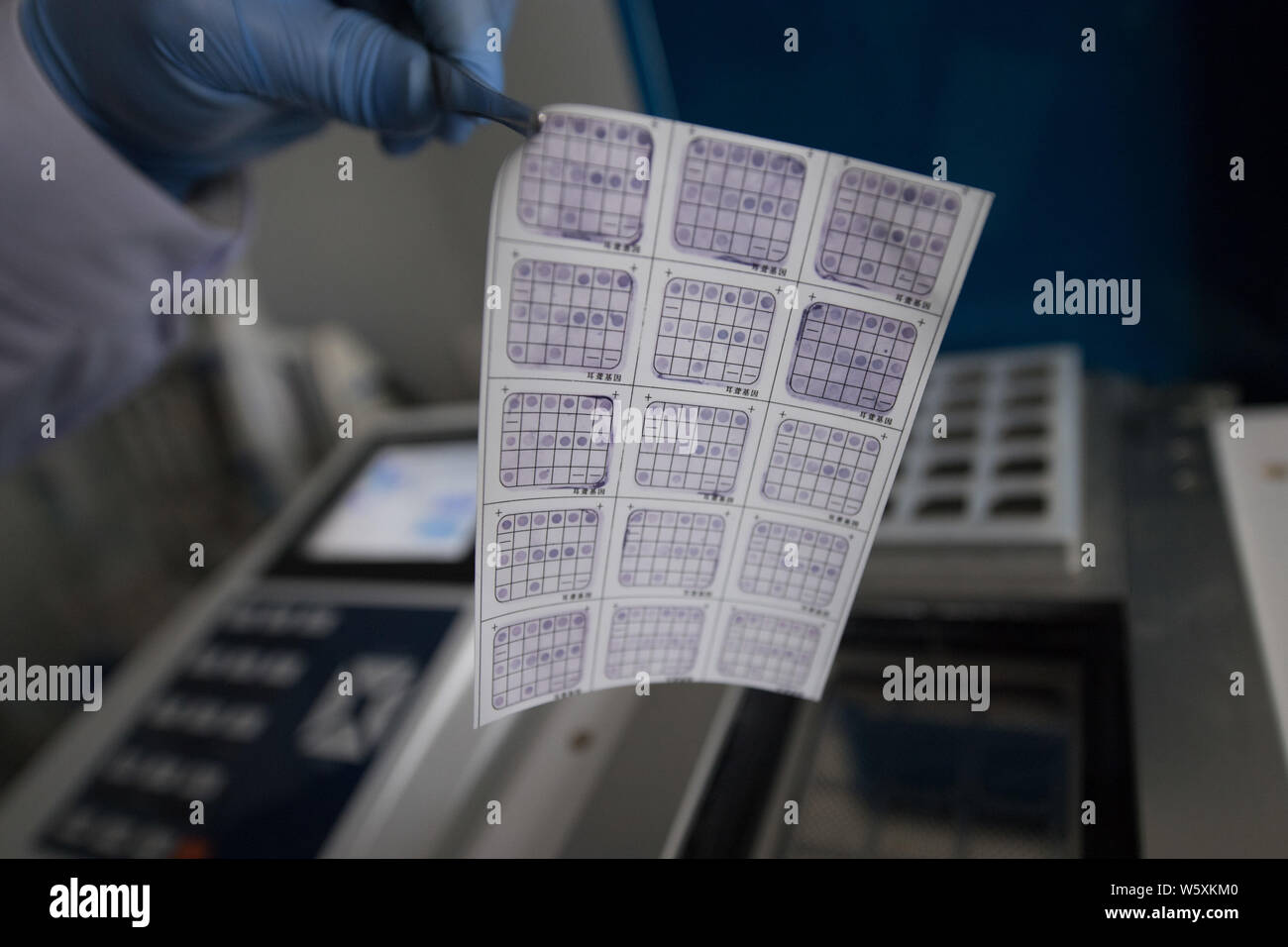 A Chinese medical worker performs genetic testing on fertilized eggs or ...