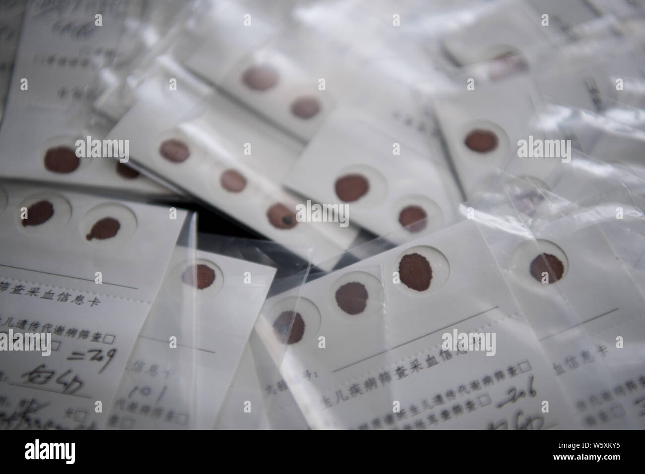 Newborn genetic testing hi-res stock photography and images - Alamy