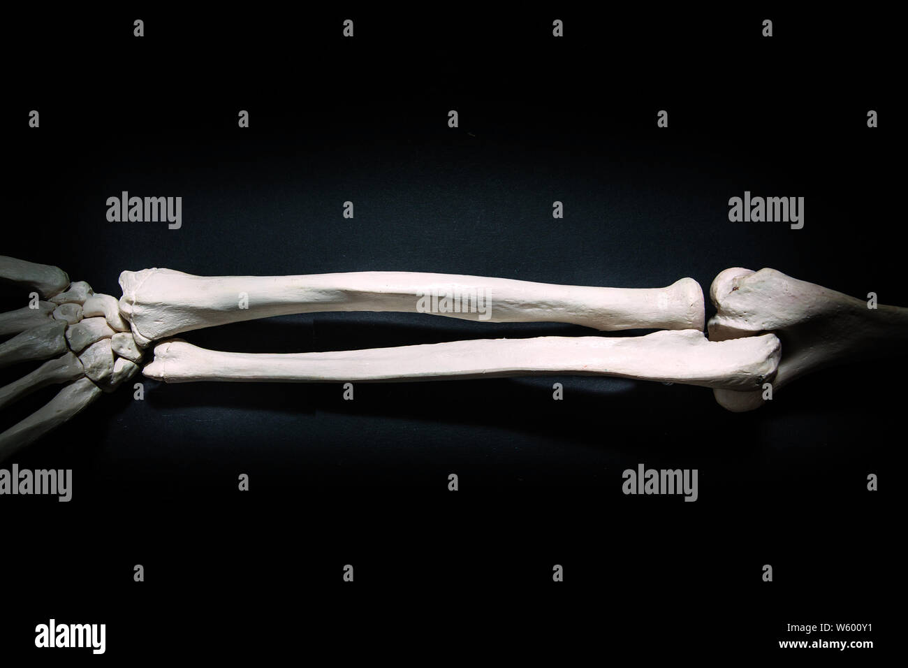 Real Radius Bone