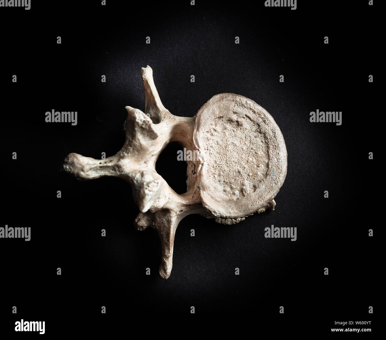Vertebra human bone close up isolated on black background Stock Photo ...