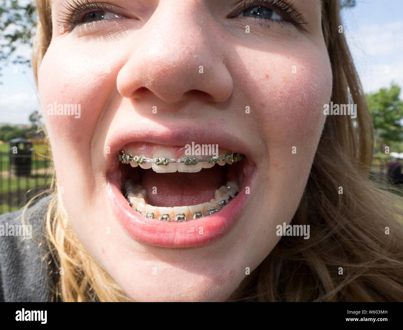 Girl crooked teeth smiling hi-res stock photography and images - Alamy