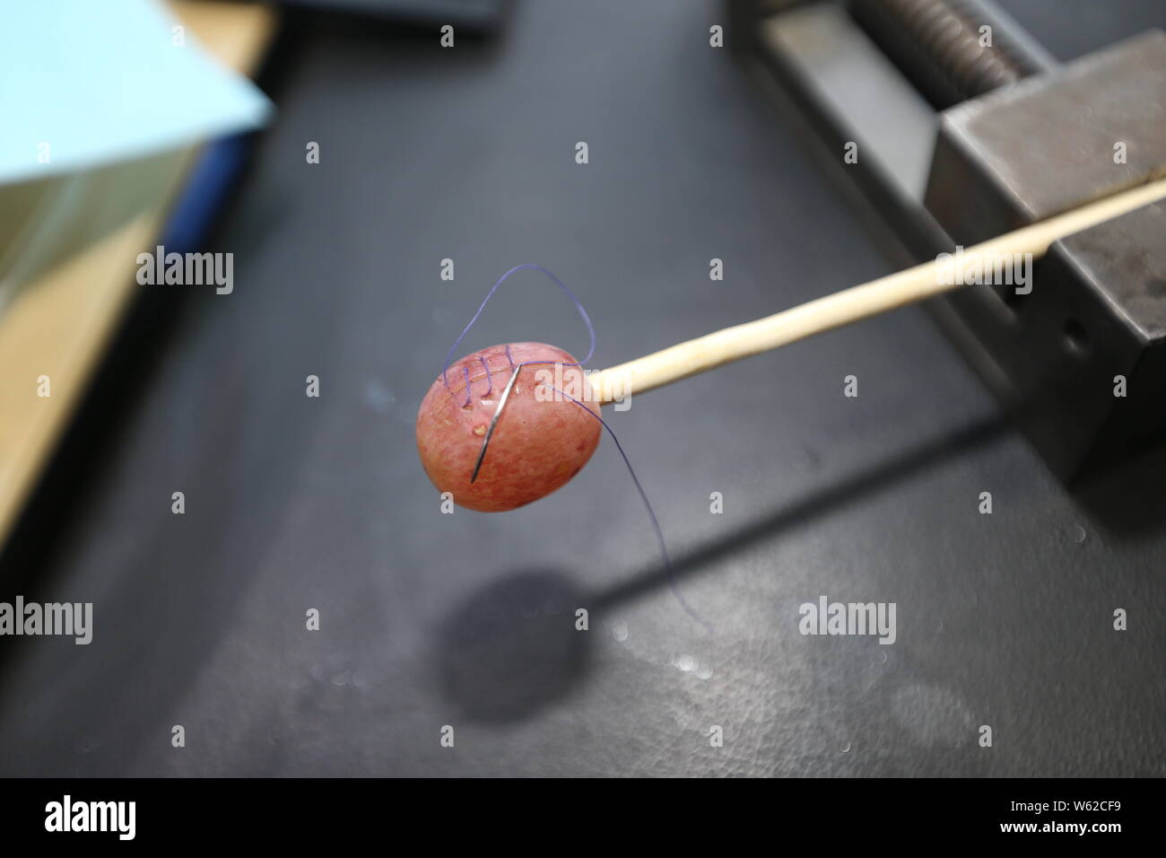 Laparoscopic surgery hi-res stock photography and images - Alamy