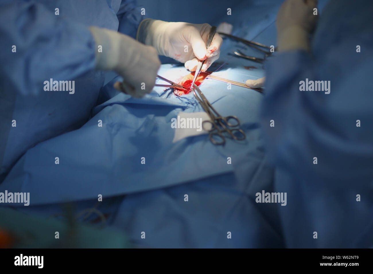 The doctor at work. During a surgical operation Stock Photo - Alamy