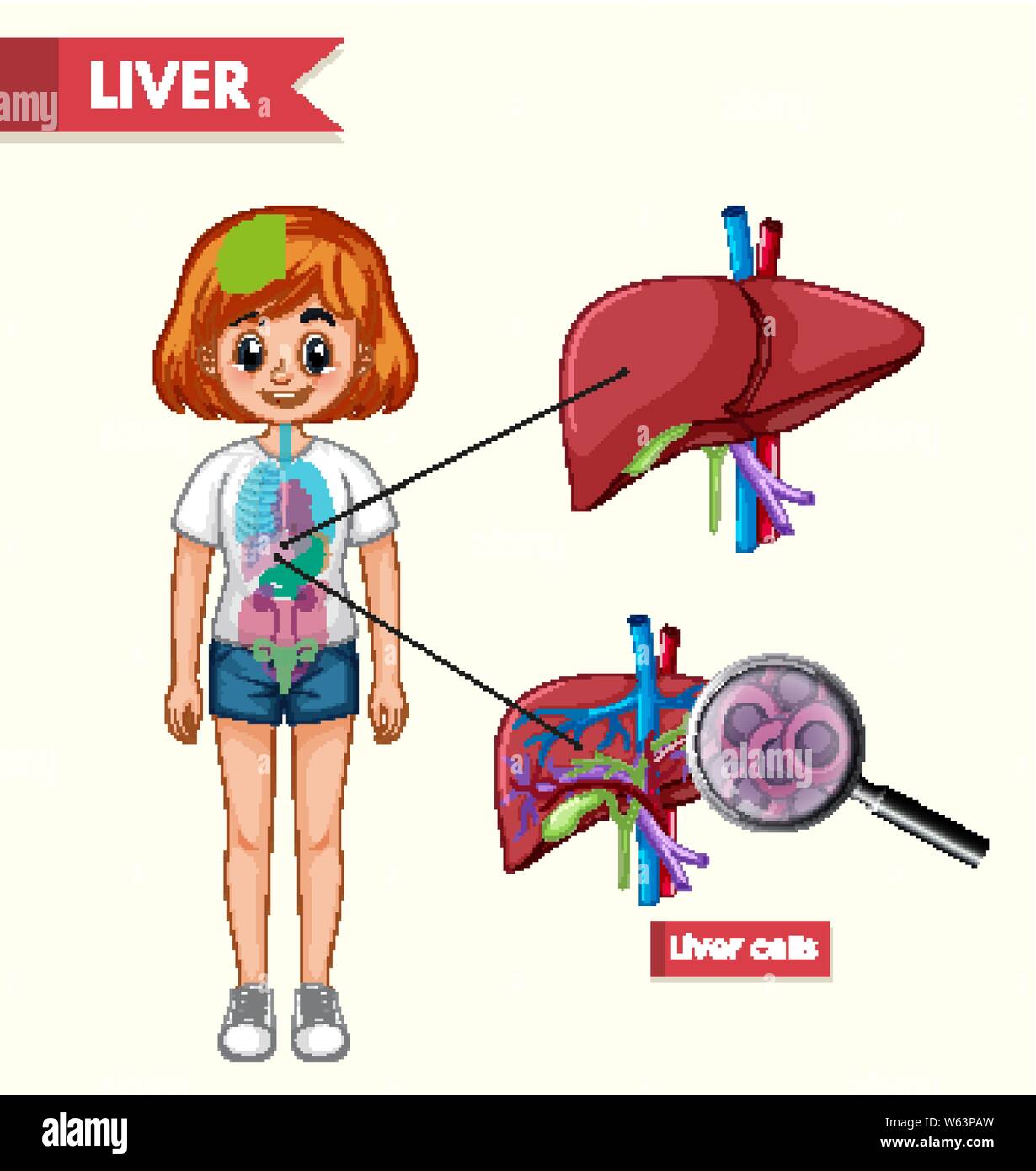 Scientific medical illustration of kidney disease illustration Stock ...