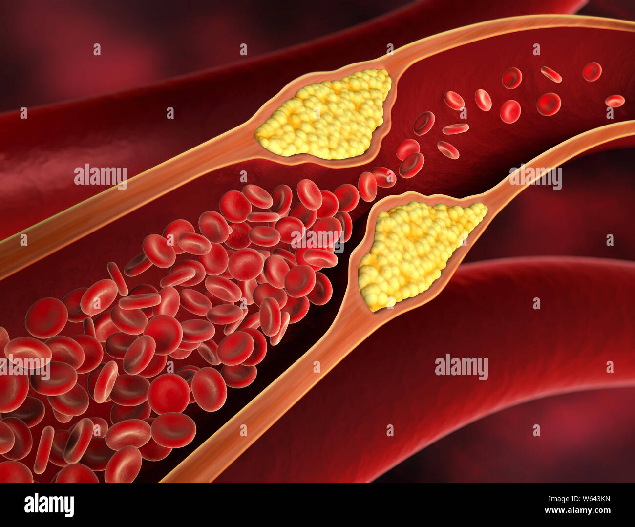 Red blood cells - narrowing inside a blood vessel - Erythrocyte 3D ...