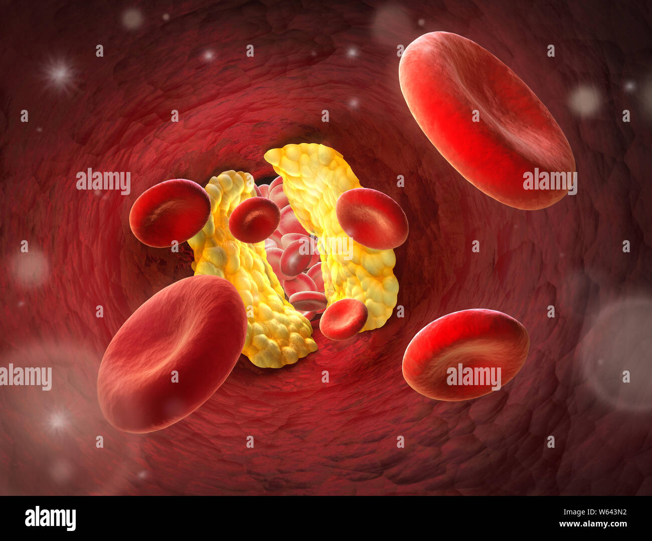 Red blood cells - narrowing inside a blood vessel - Erythrocyte 3D ...