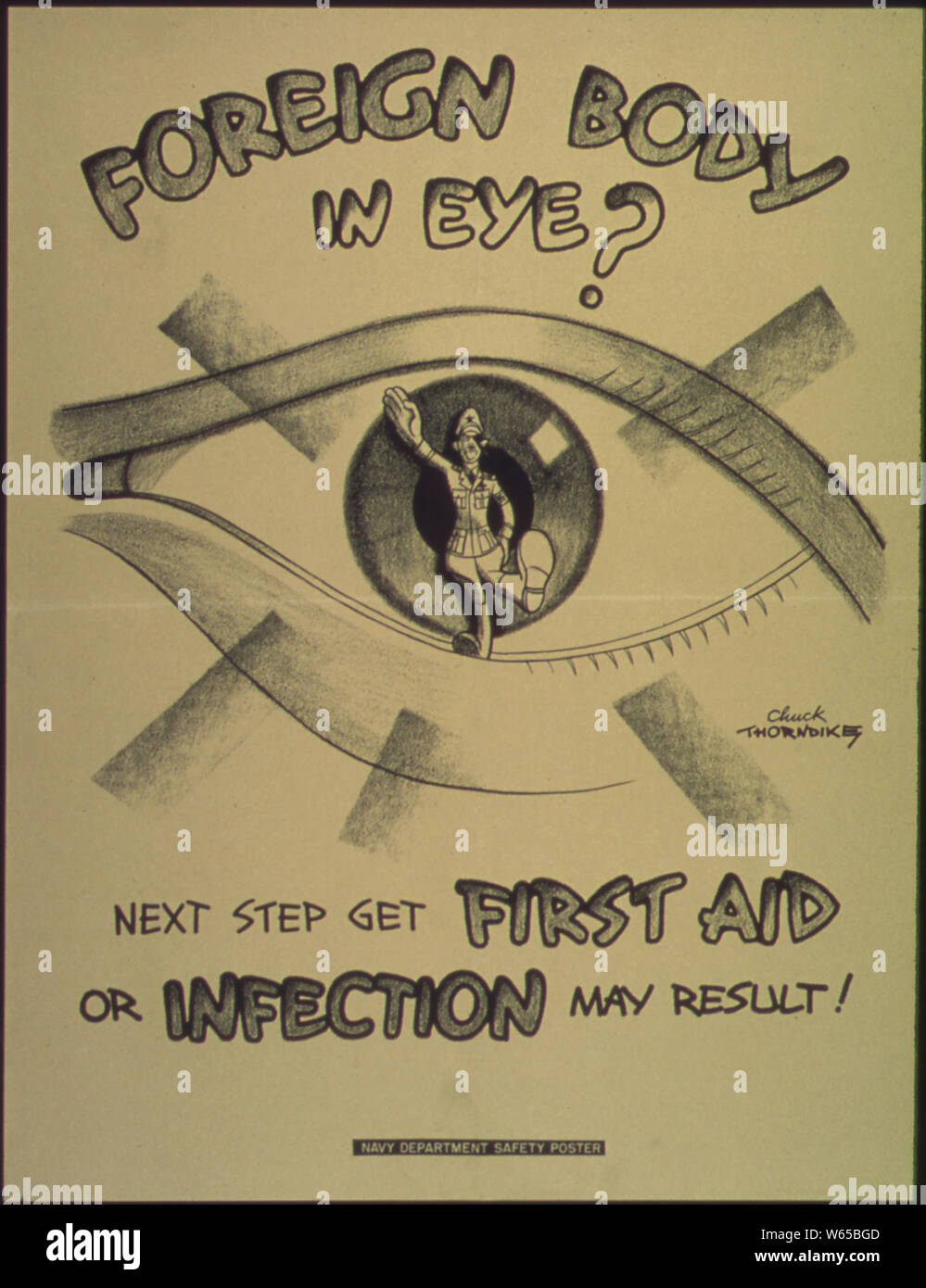 Foreign body eye hi-res stock photography and images - Alamy