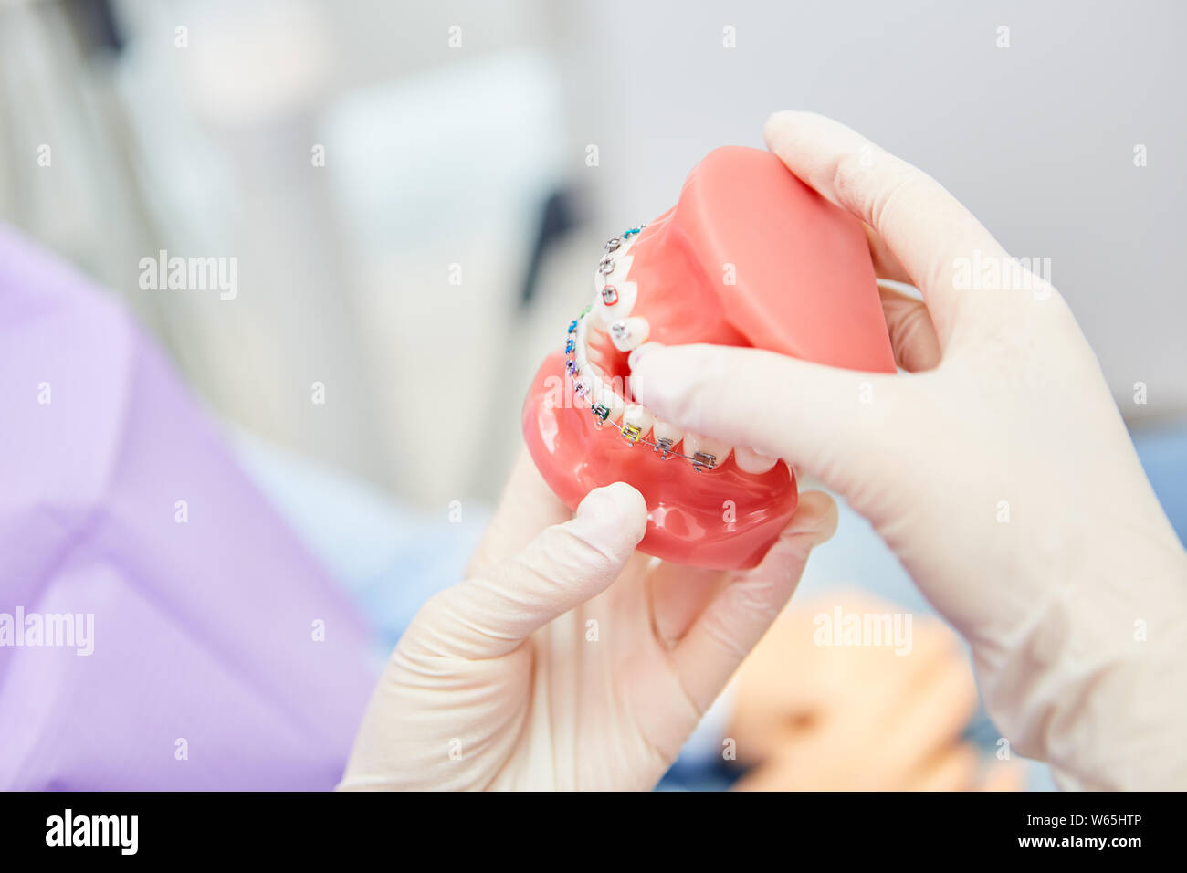Dentist shows braces on a denture model before treatment as an example ...