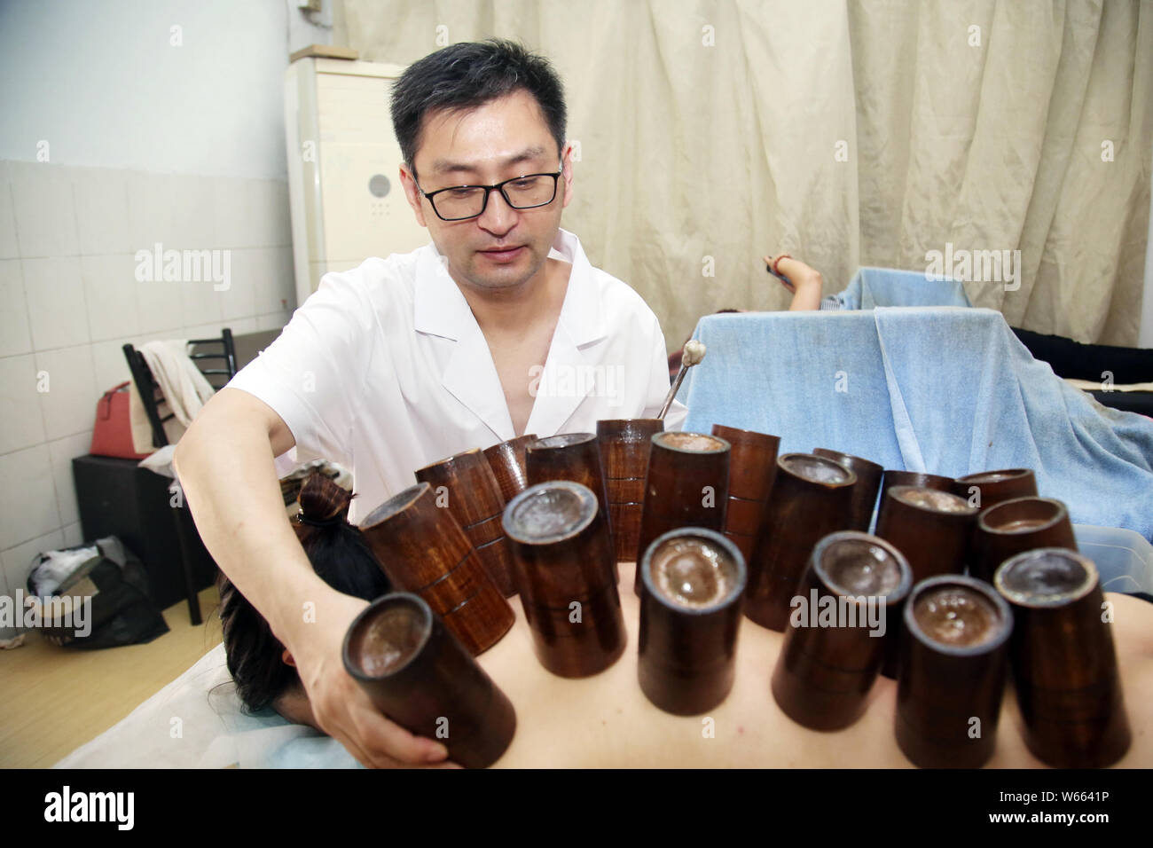 A doctor applies the cupping technique of traditional Chinese medicine ...