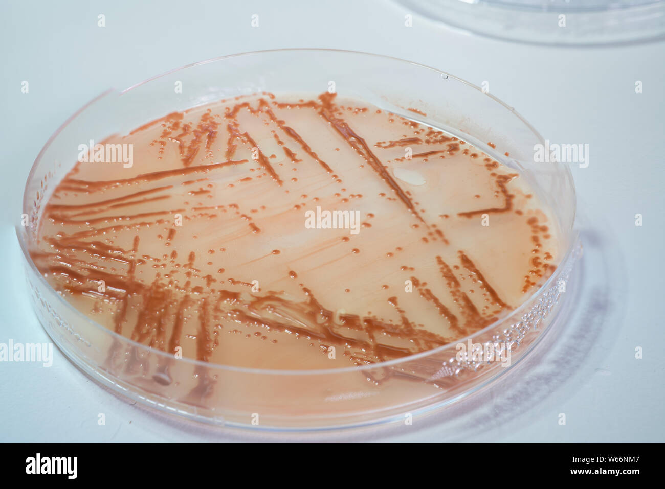 Sowing human feces in a petri dish Stock Photo - Alamy