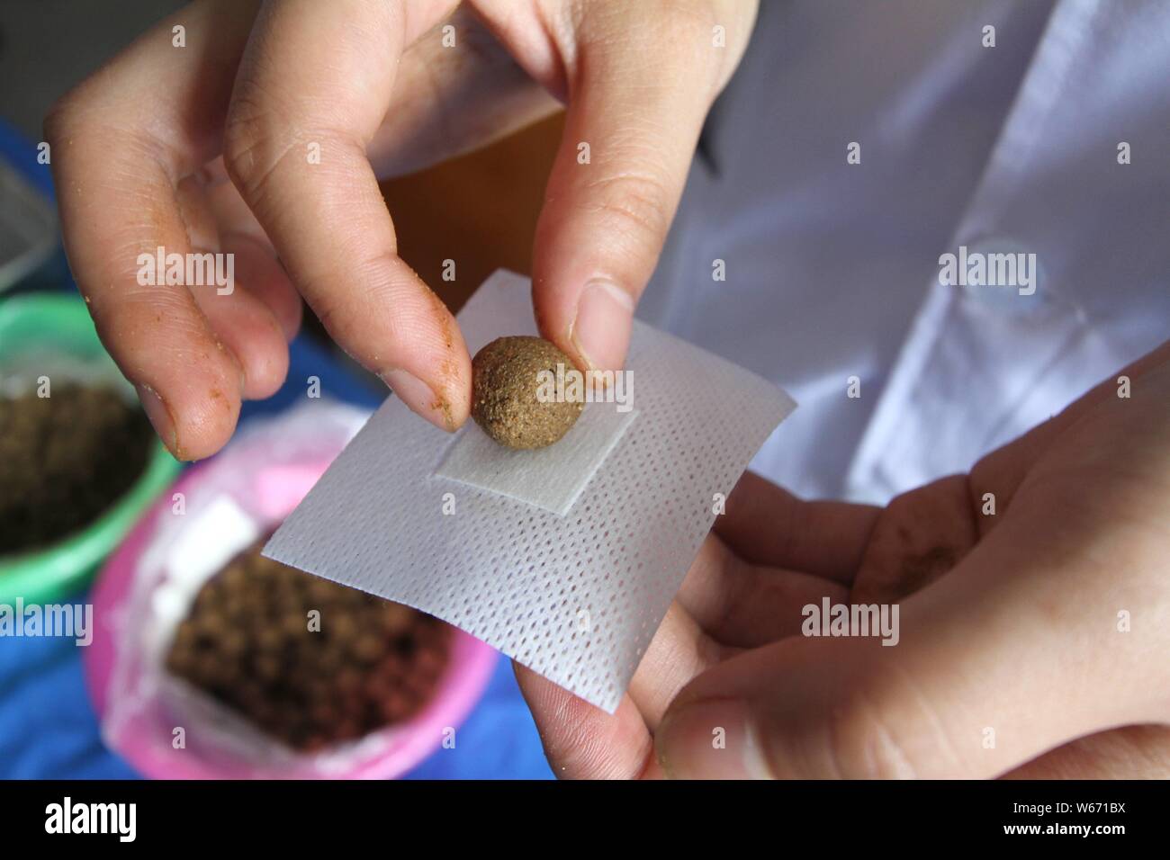 A doctor prepares the Sanfu Paste, a traditional Chinese medicine ...