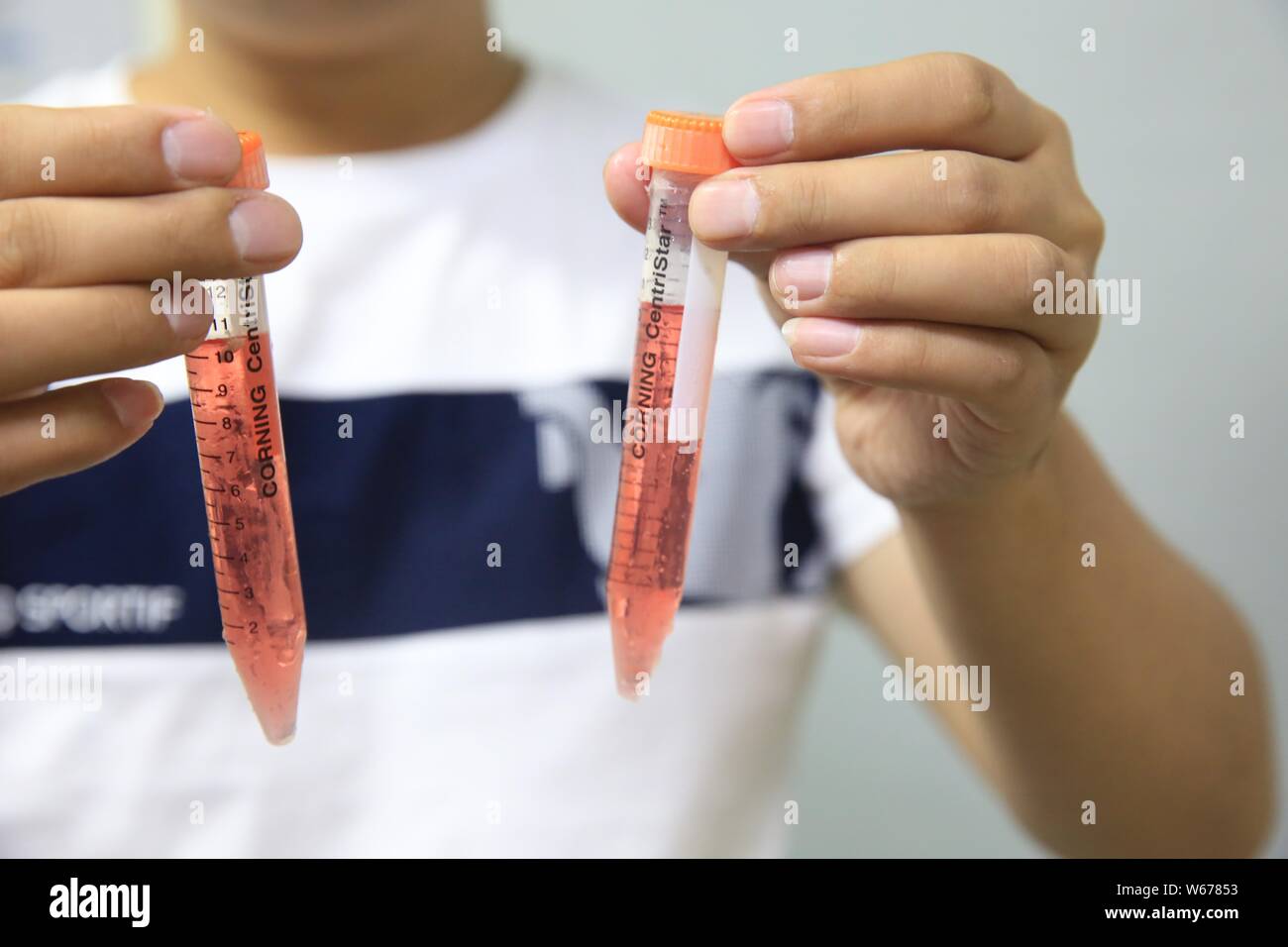 Somatic cell hi-res stock photography and images - Alamy