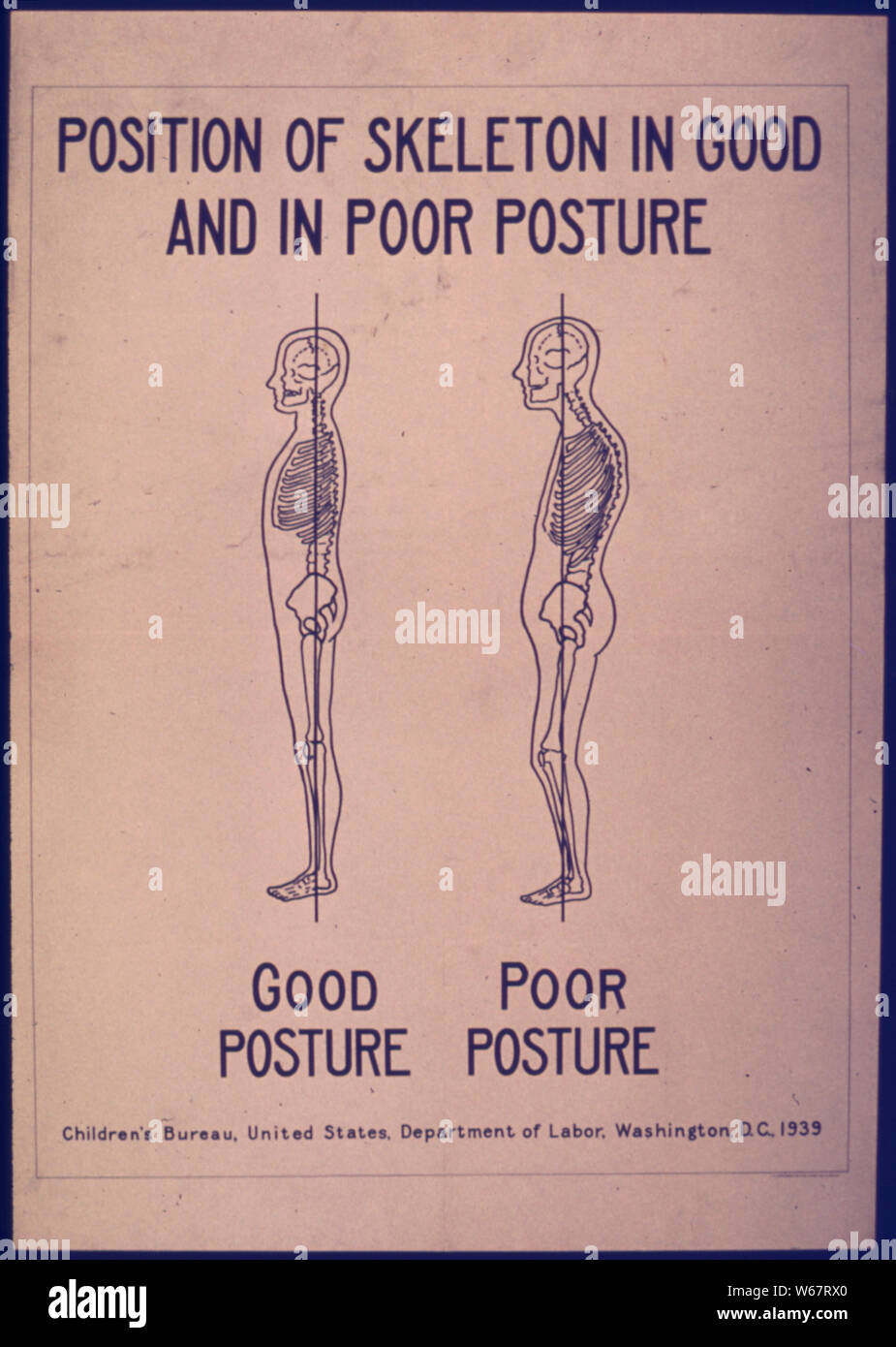 POSITION OF SKELETON IN GOOD AND POOR POSTURE Stock Photo - Alamy