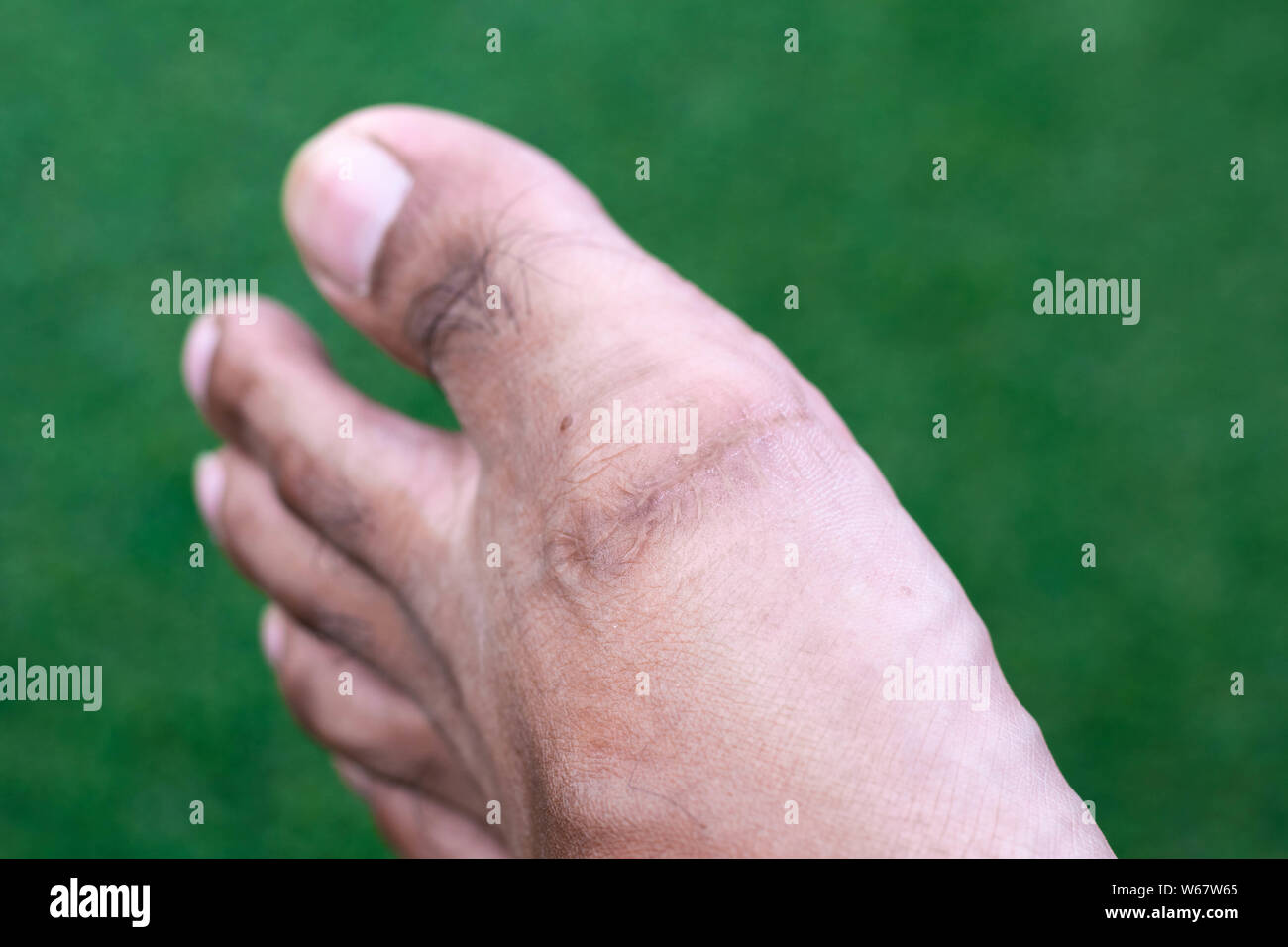 Blood vessels of the foot hi-res stock photography and images - Alamy