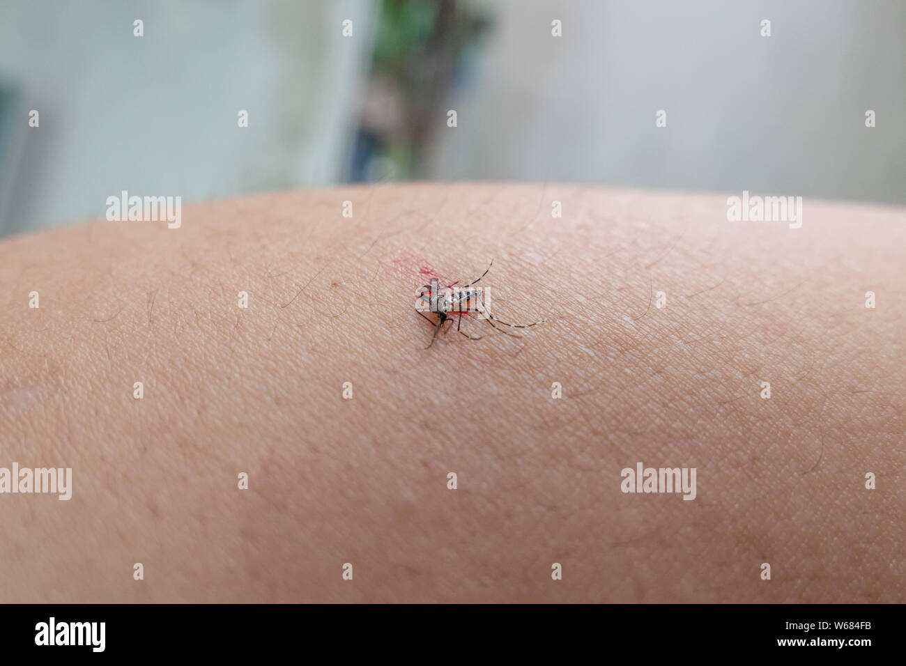 Human gore hi-res stock photography and images - Alamy