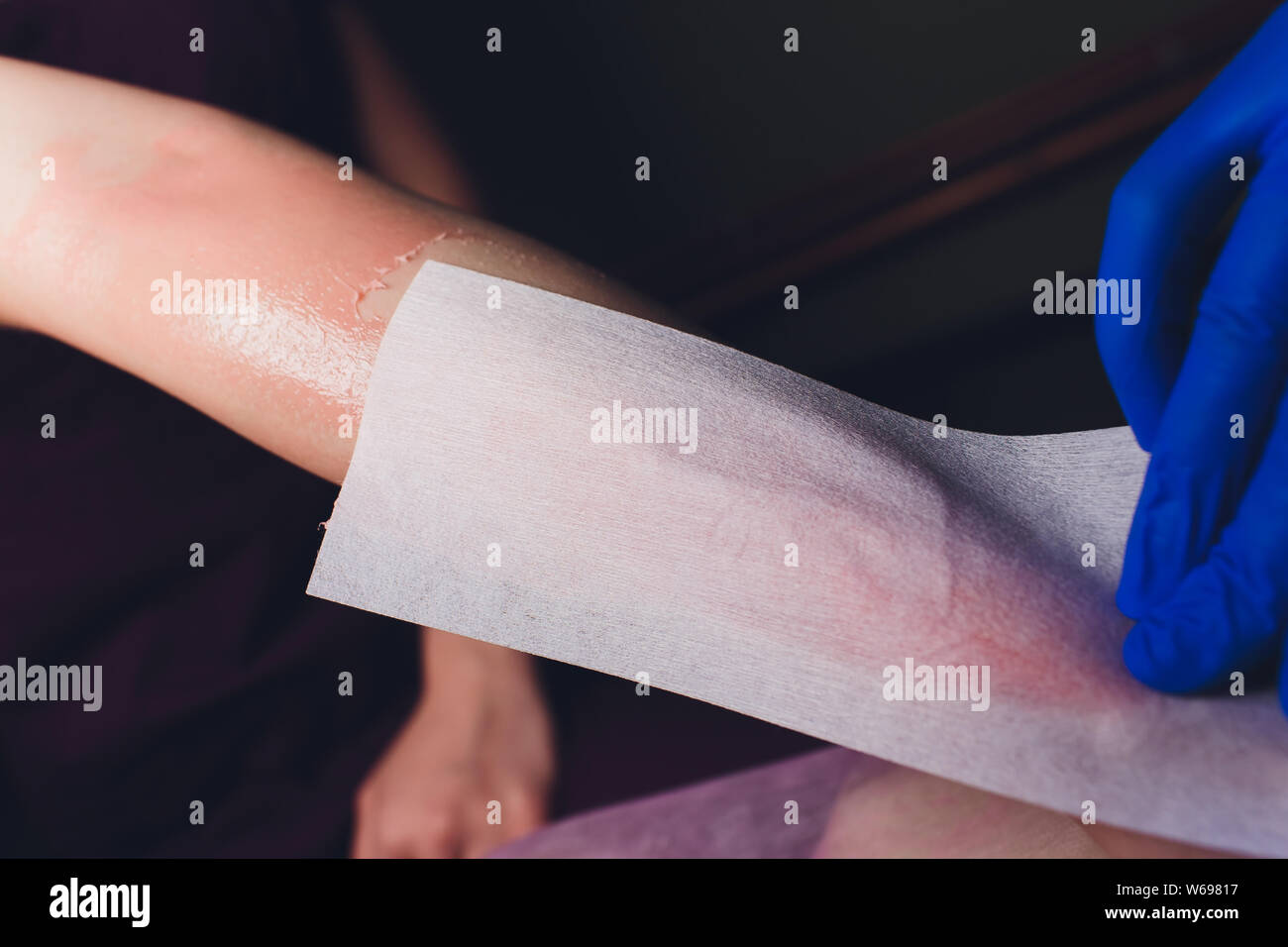 Sugaring. Beauty Concept. Young beautiful girl with dark hair gets the ...