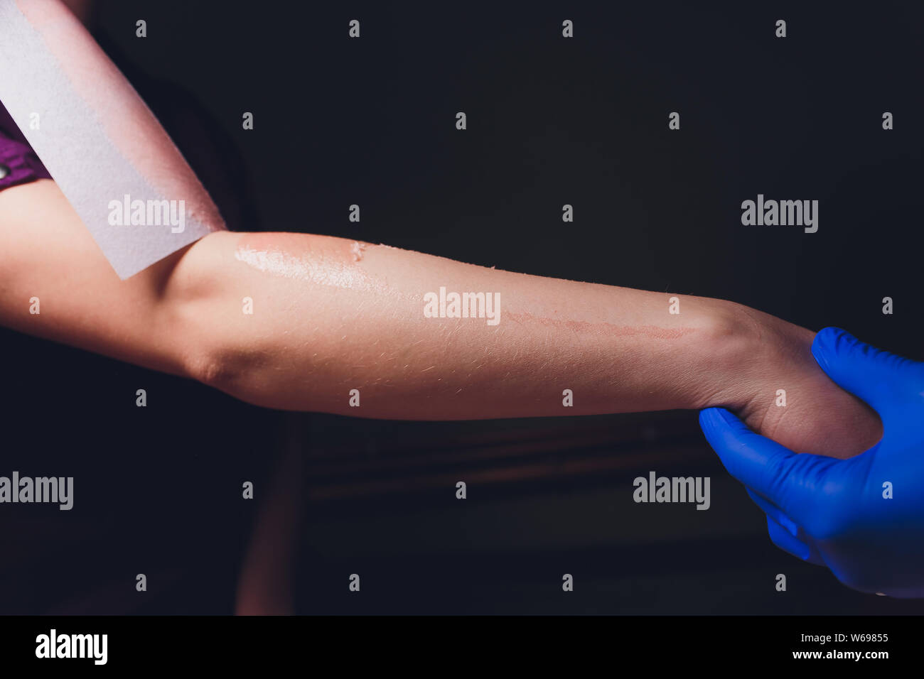Sugaring. Beauty Concept. Young beautiful girl with dark hair gets the ...