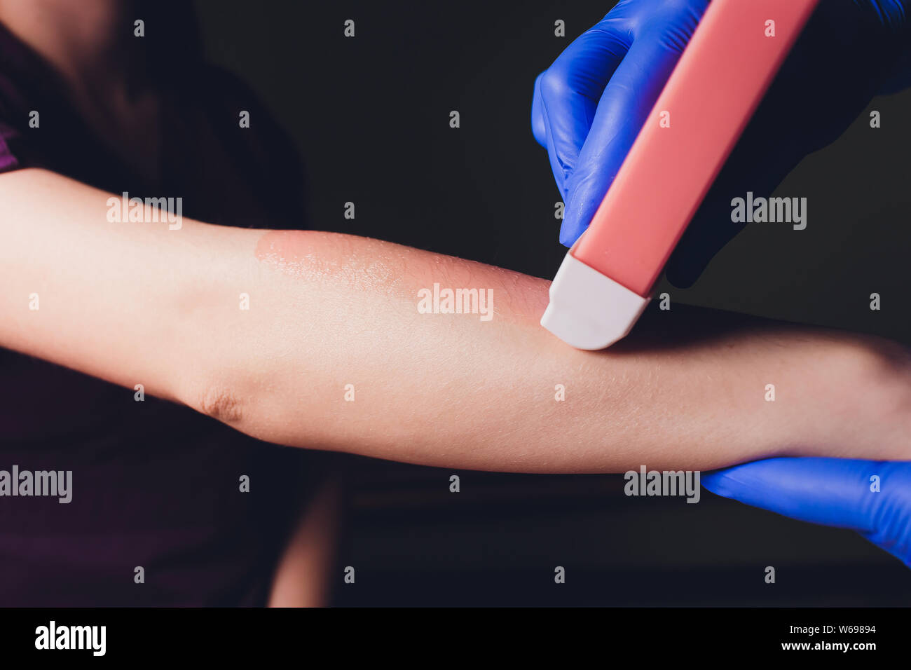Sugaring. Beauty Concept. Young beautiful girl with dark hair gets the ...