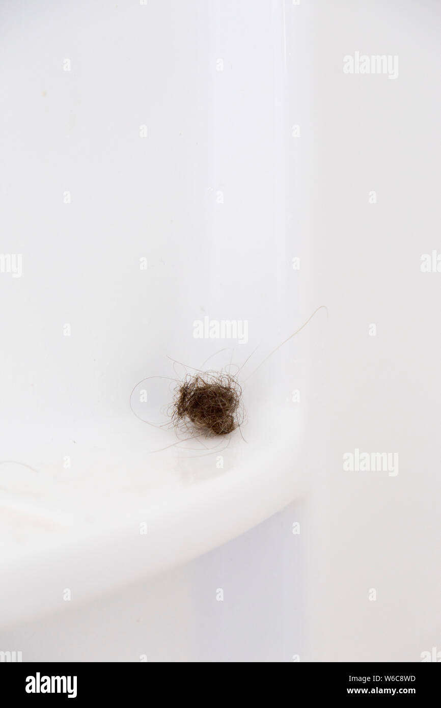 Hair balls in the shower. Hair falling out after pregnancy and ...