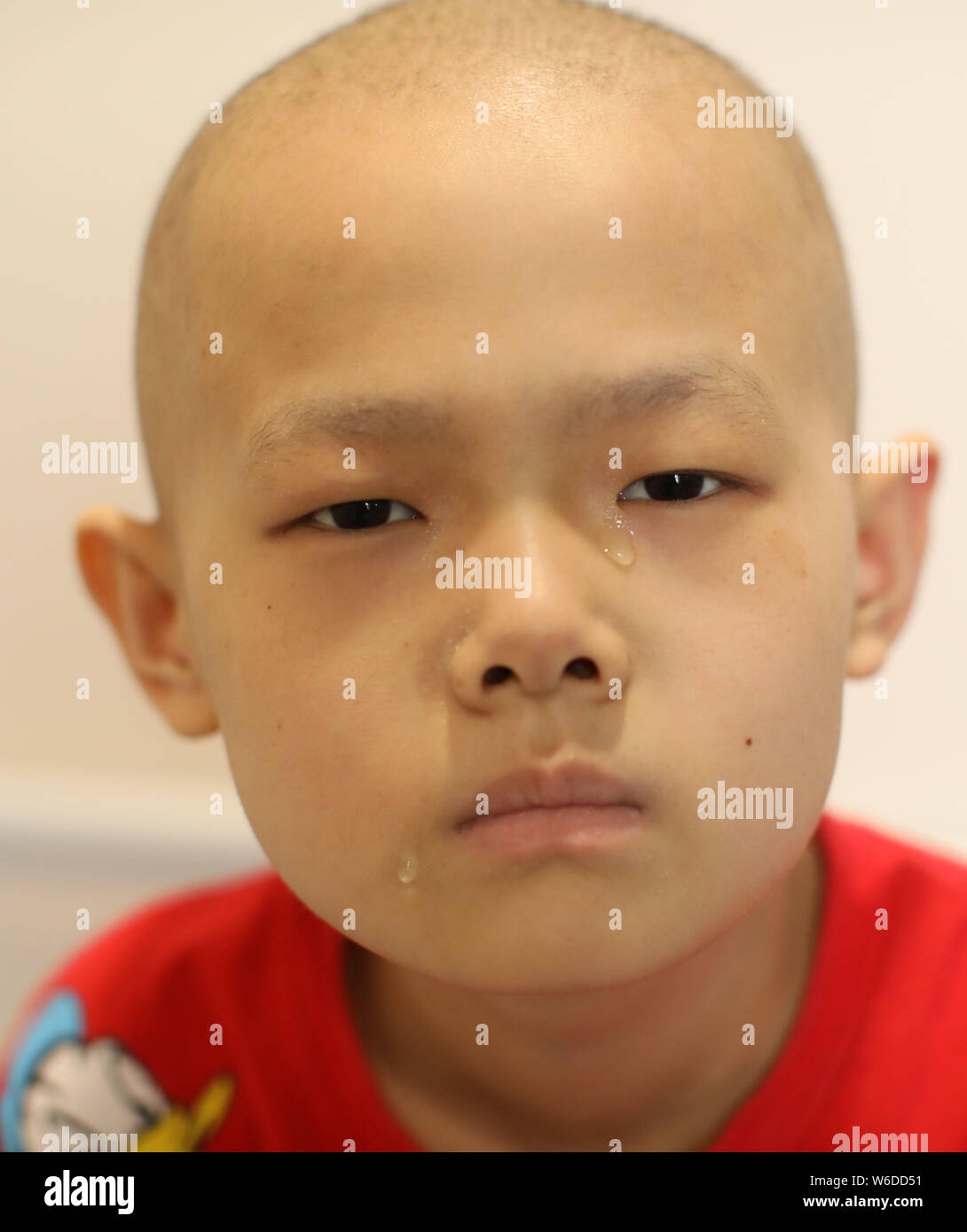 --FILE--9-year-old Chinese girl Gong Miao diagnosed with acute ...