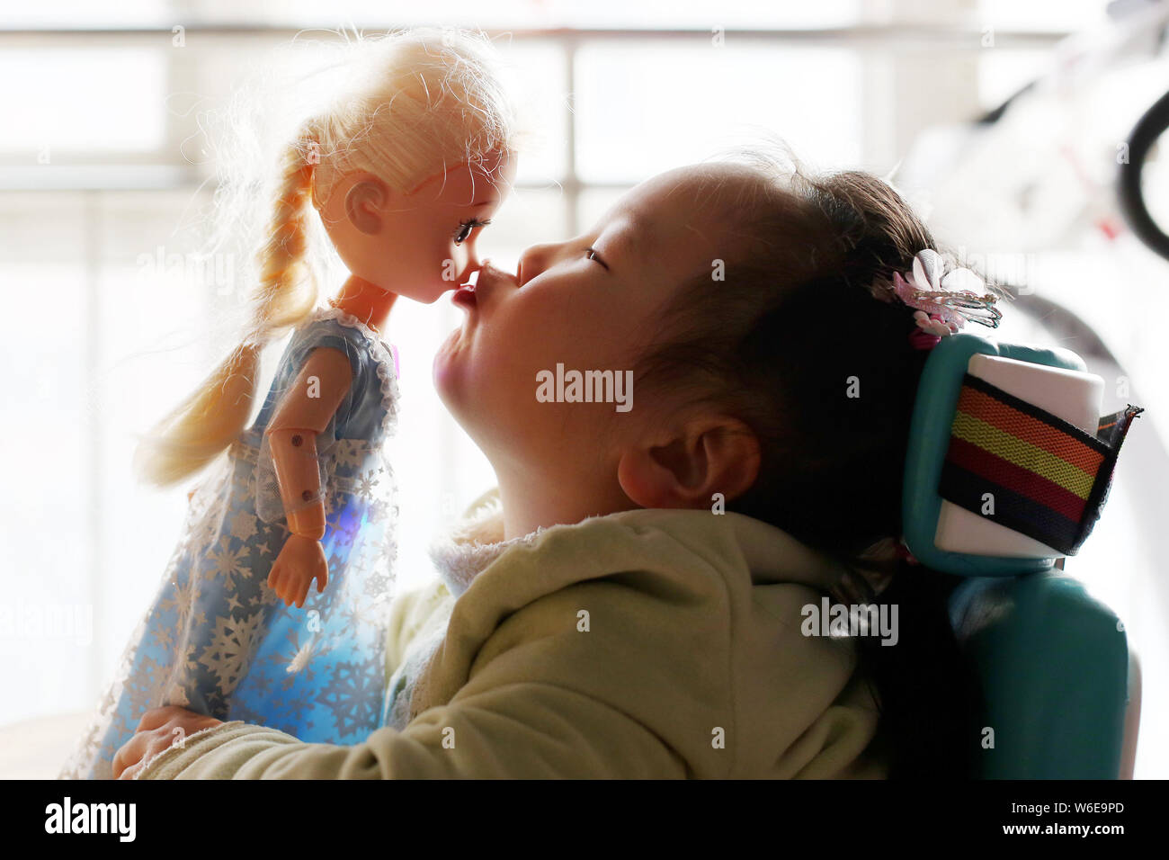 5-year-old "sponge girl" Lele diagnosed with Spinal muscular atrophy ...