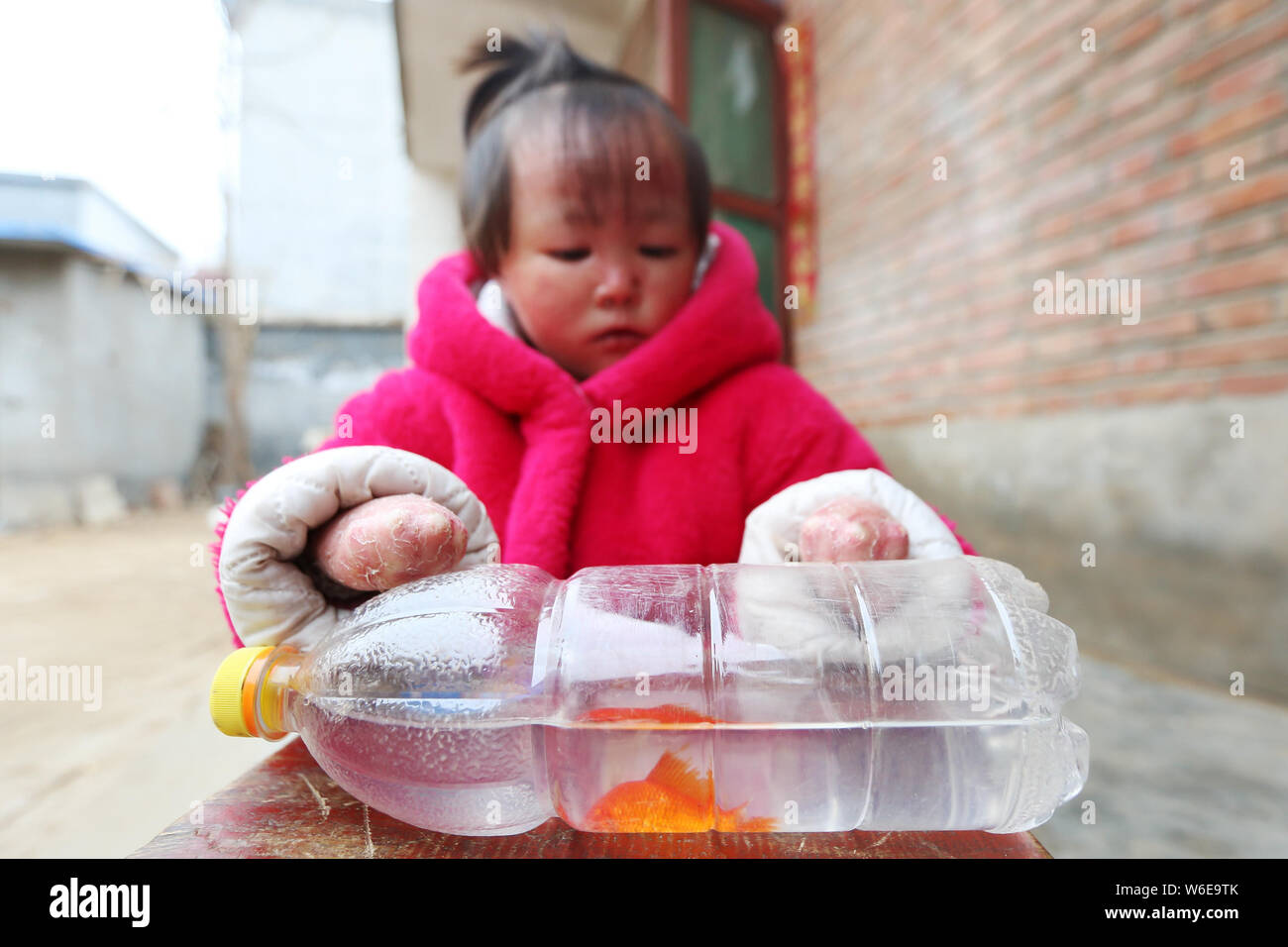 6-year-old "butterfly girl" Li Yeqing diagnosed with Epidermolysis ...