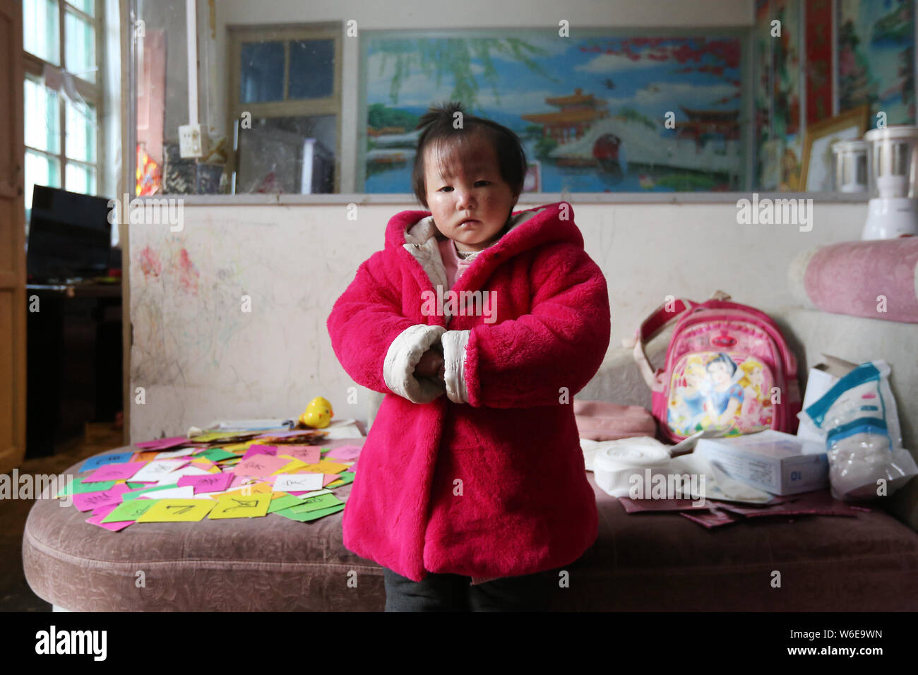 6-year-old "butterfly girl" Li Yeqing diagnosed with Epidermolysis ...