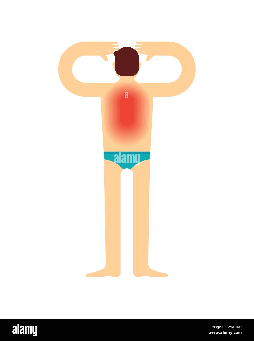 Man sun burn back Stock Vector Images - Alamy