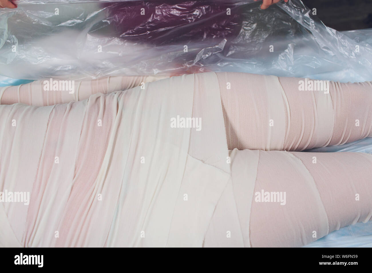 Anti cellulite body wrap hi-res stock photography and images - Alamy