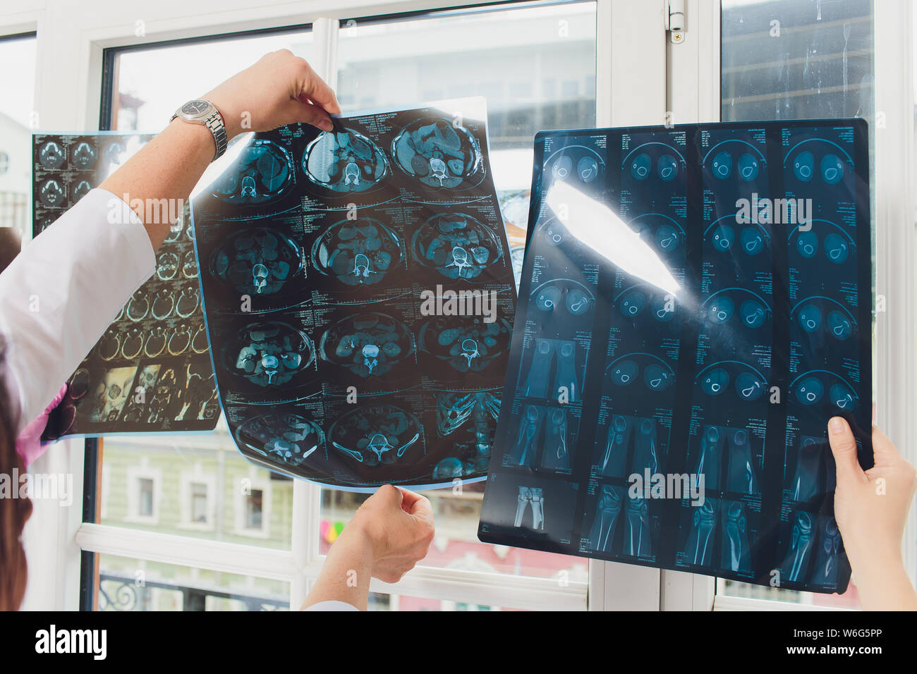 Professional medical team examining patient's medical records and x-ray ...