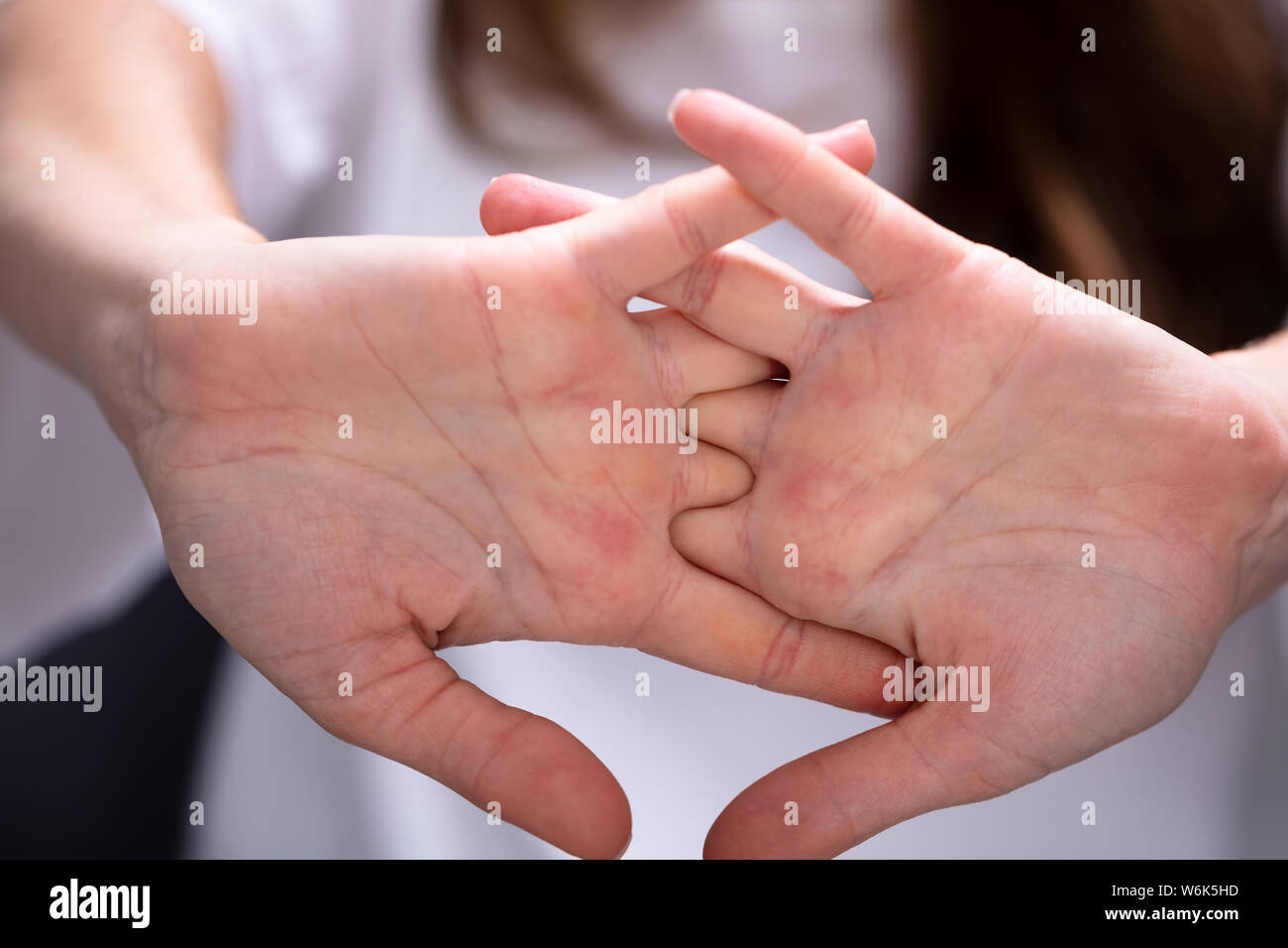 Close-up Of Woman Cracking Their Knuckles At Home Stock Photo - Alamy