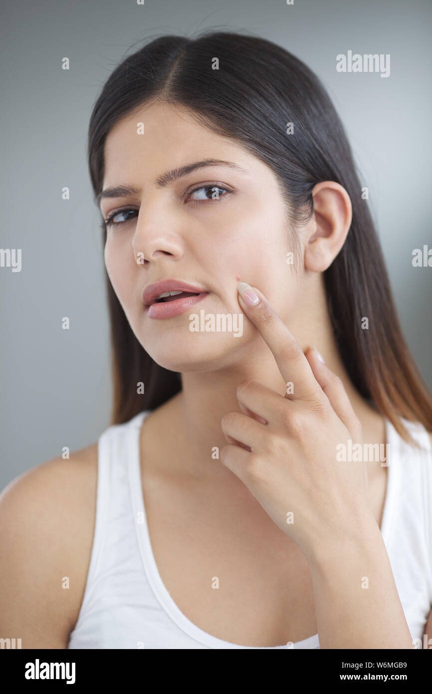 Pimple skin model hi-res stock photography and images - Alamy