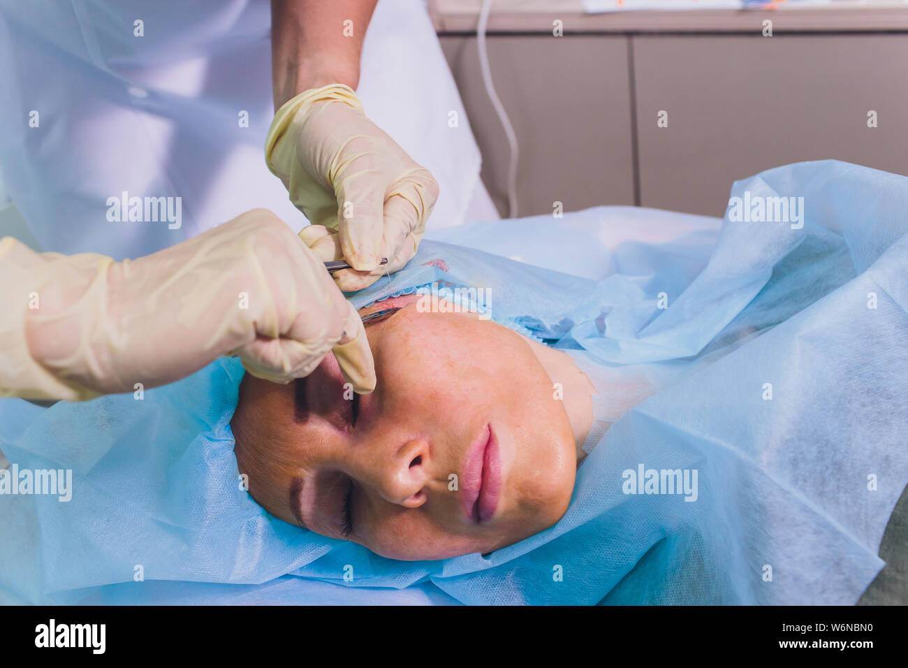 Aged woman doing mesothreads and Thread Lifting, Cosmetology. Cosmetic ...