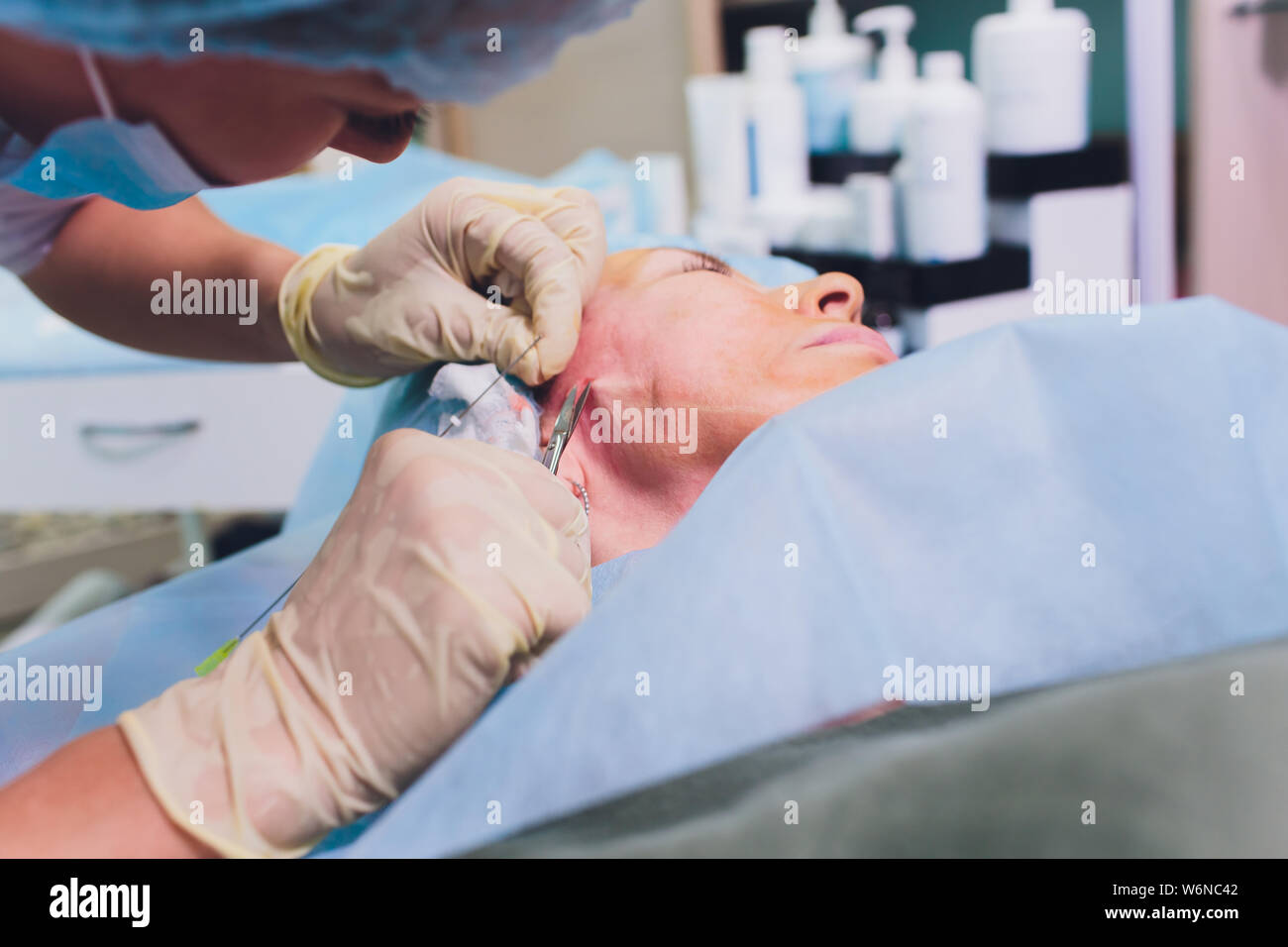 Aged woman doing mesothreads and Thread Lifting, Cosmetology. Cosmetic ...