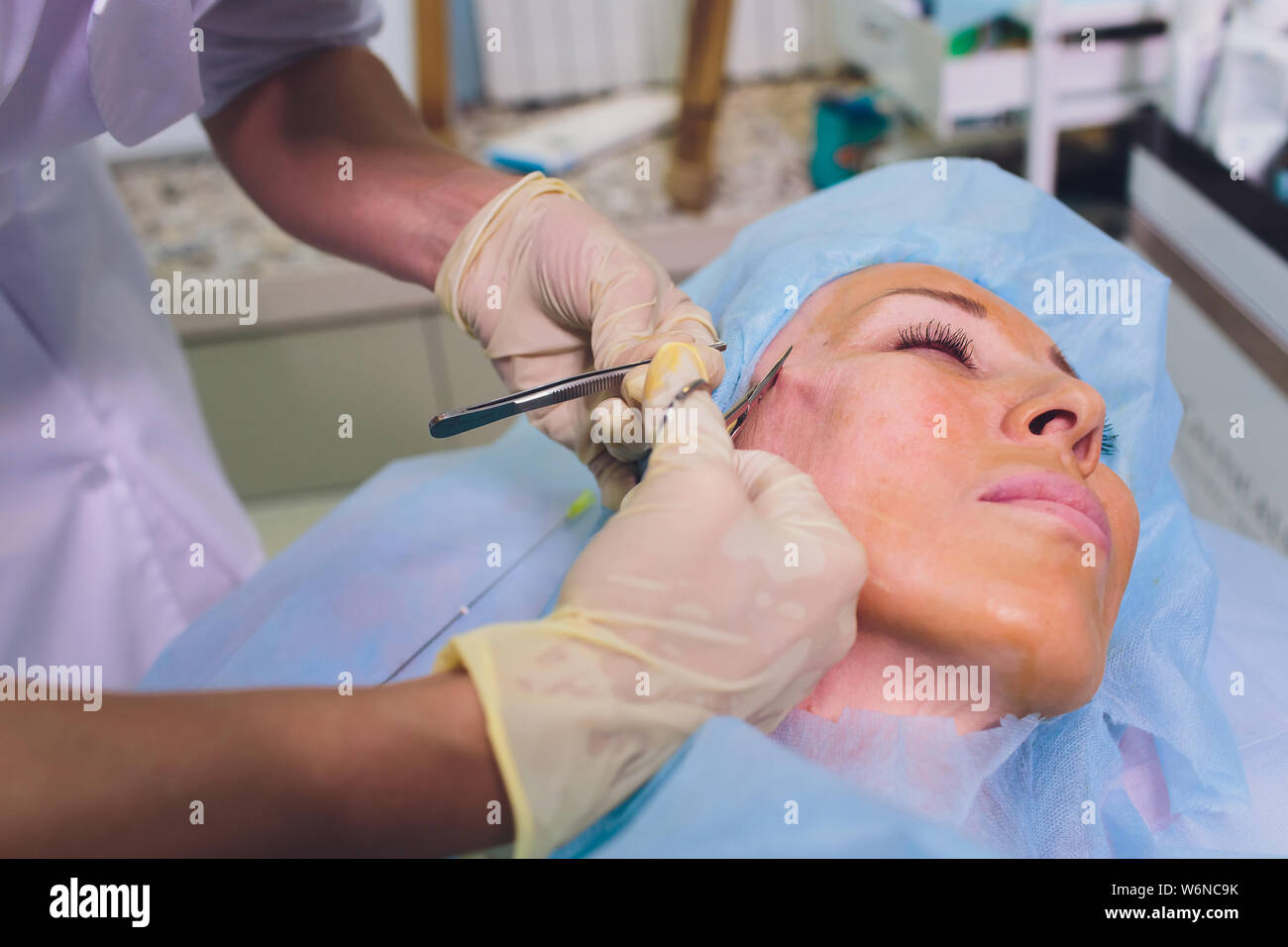 Aged woman doing mesothreads and Thread Lifting, Cosmetology. Cosmetic ...